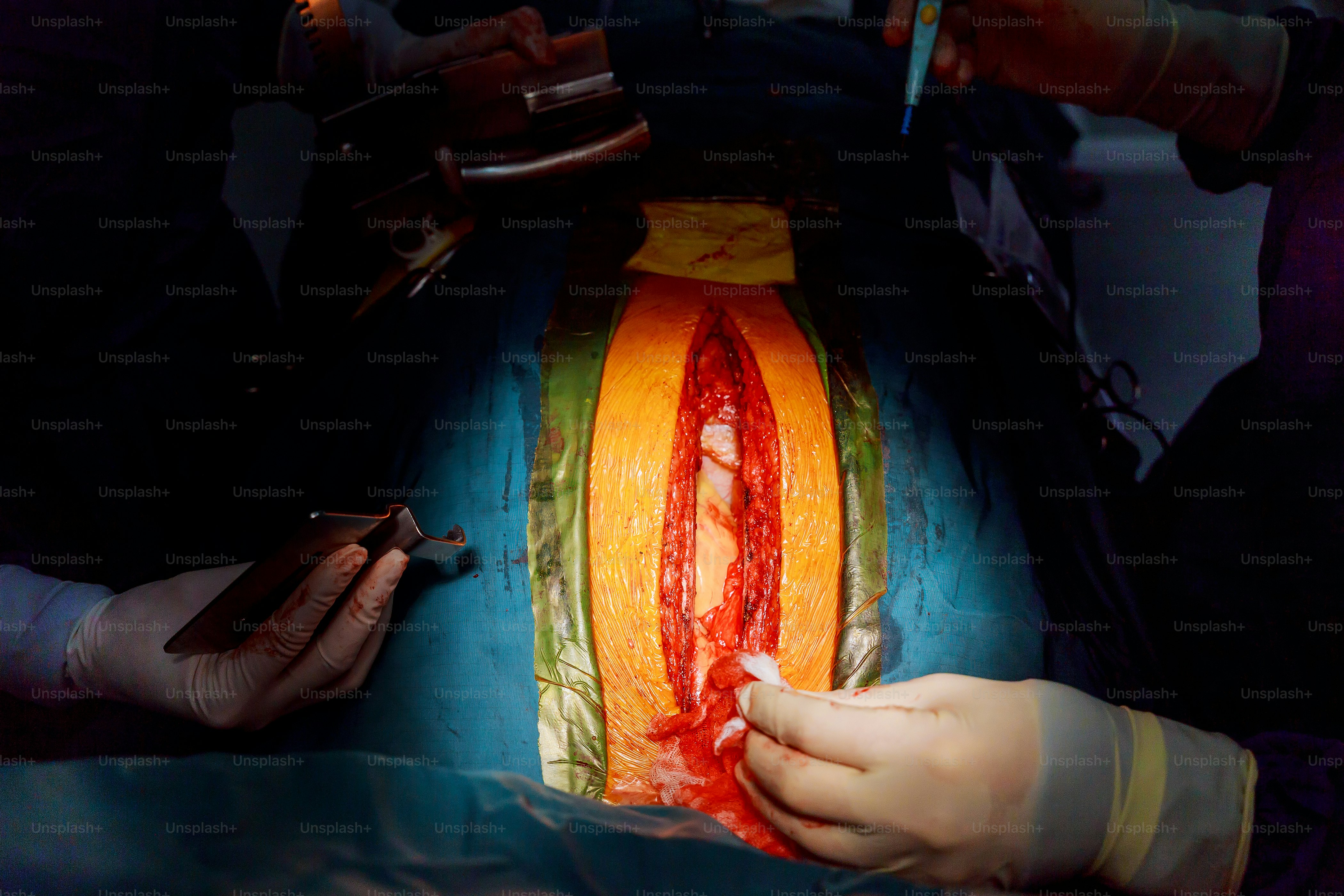 Close-up shot of surgeon and his assistant performing cosmetic surgery ...