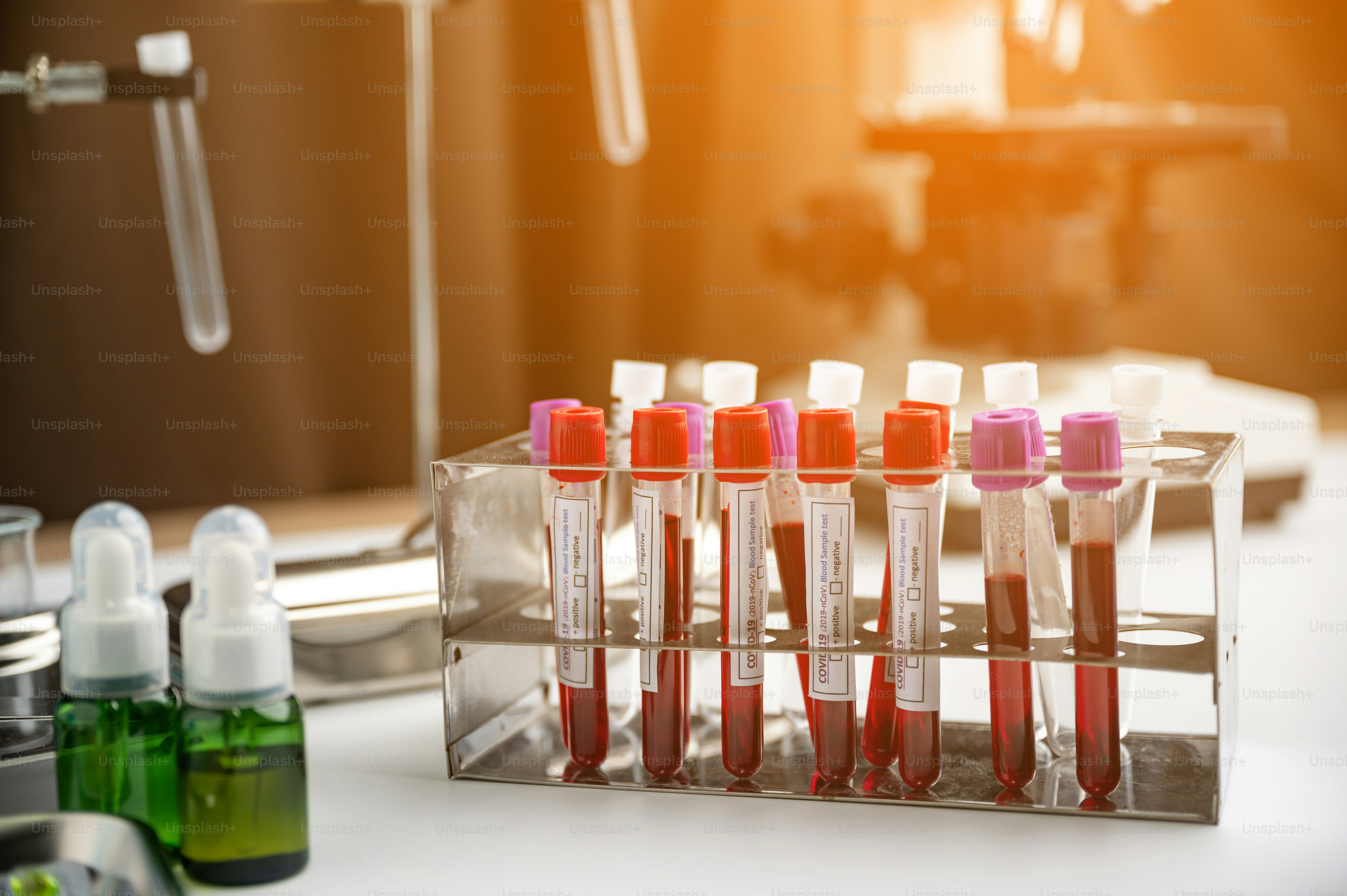 A row of human blood samples in a medical laboratory ready to be tested ...