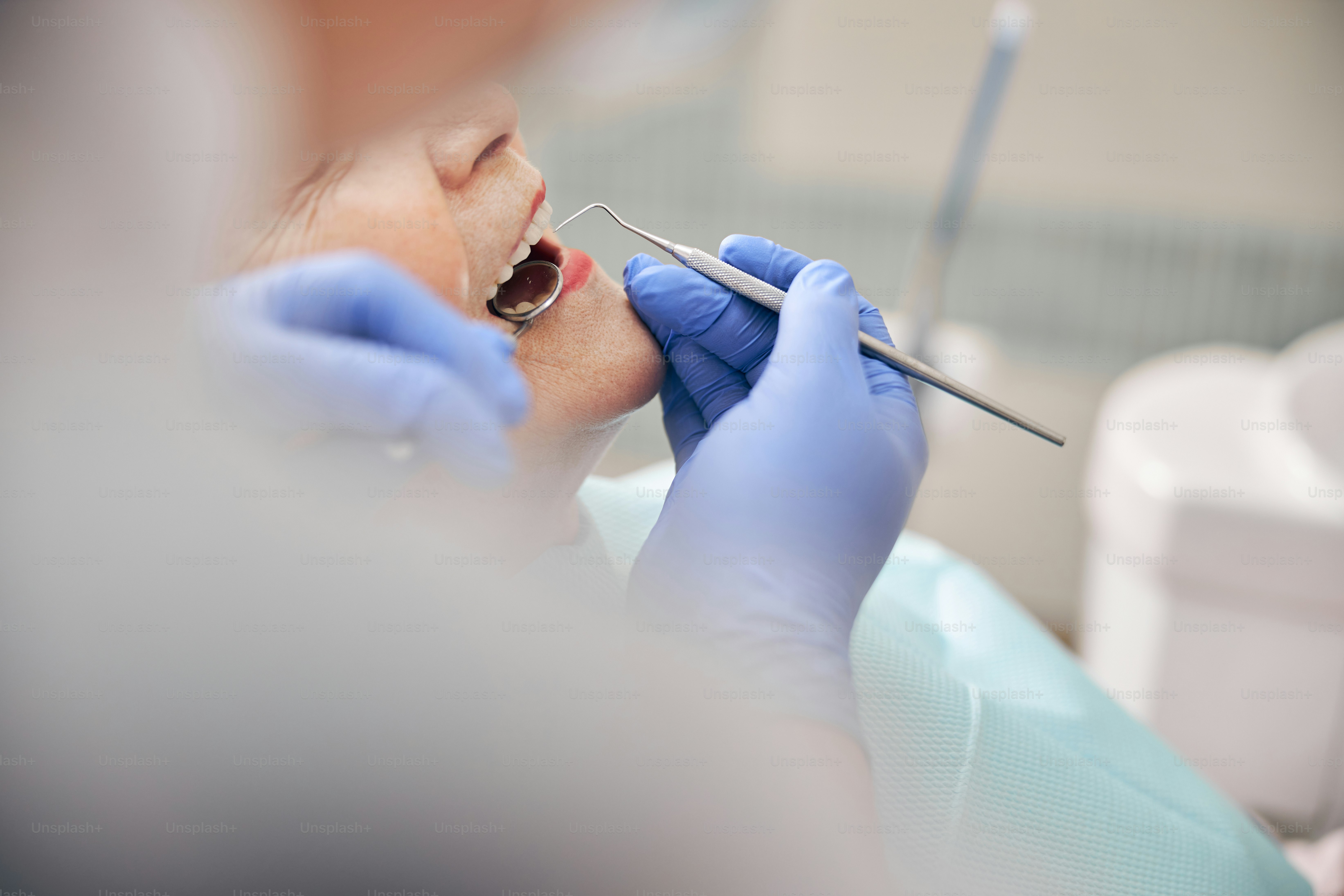 Dental Implant Pictures | Download Free Images on Unsplash