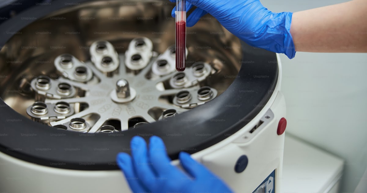 라텍스 장갑을 낀 생화학자가 혈액 샘플이 있는 Vacutainer를 원심분리기에 넣는 자른 사진 사진 Unsplash의 사람 이미지