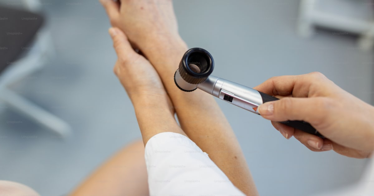 皮膚科。熟練した女性皮膚科医が、皮膚検査をしながらプロの皮膚鏡を使用しています。皮膚疾患(アレルギー、乾癬、湿疹、皮膚炎)の検査と診断。の写真