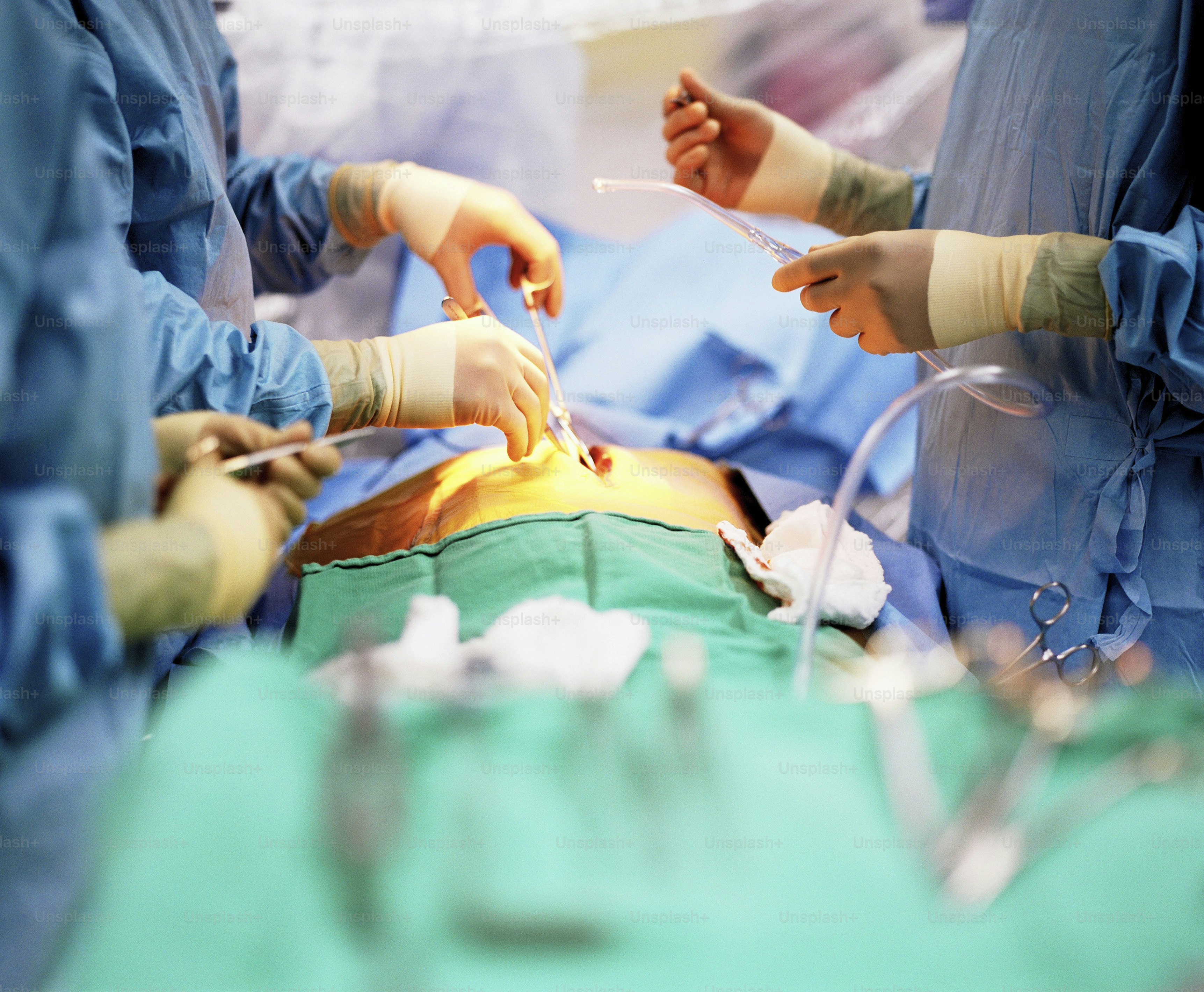 A group of doctors performing surgery on a patient photo – Surgery ...