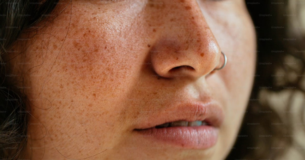 Un Primer Plano De Una Persona Con Pecas En La Cara Foto Imagen De