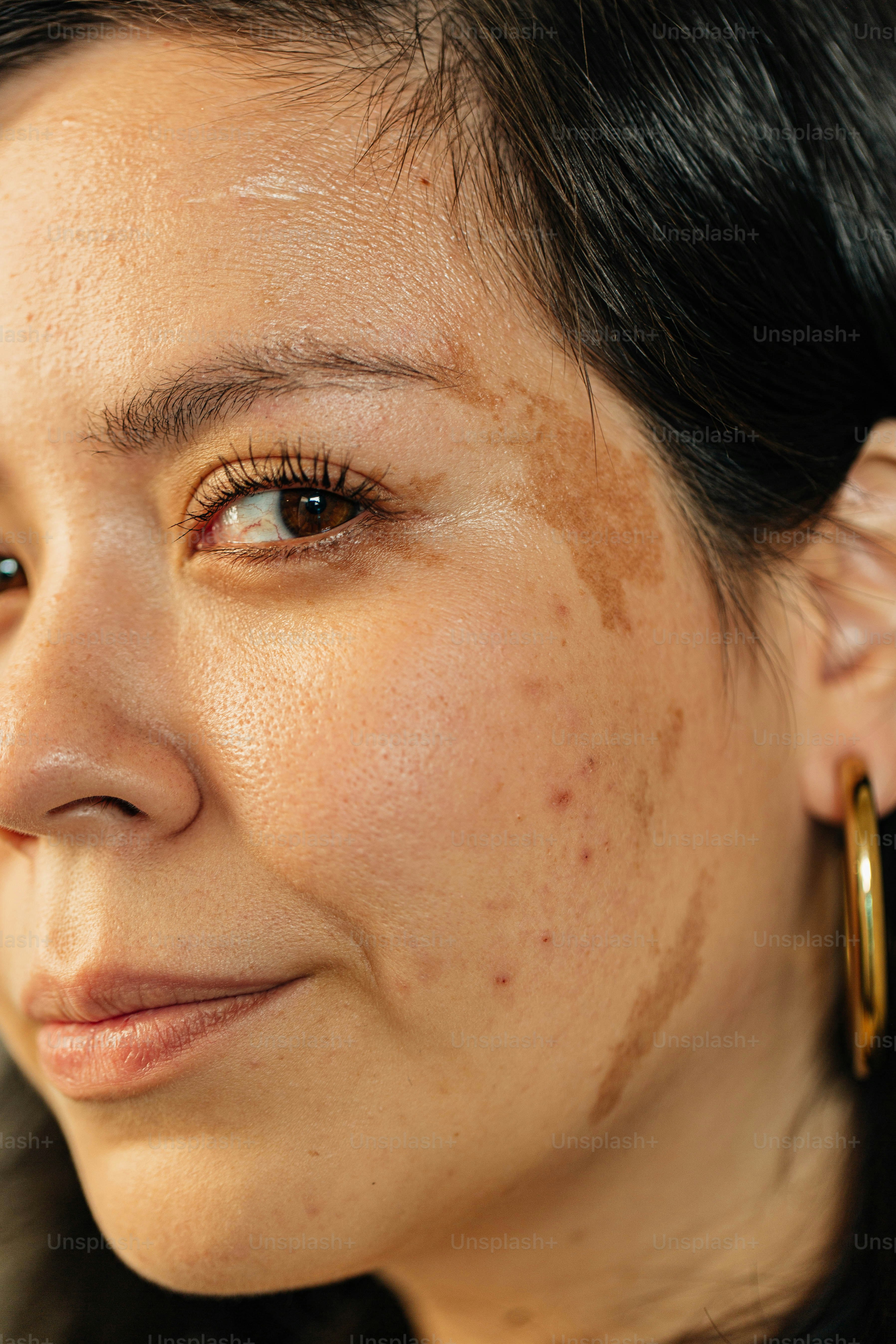 A close up of a person with freckles on her face photo – Ugly people ...