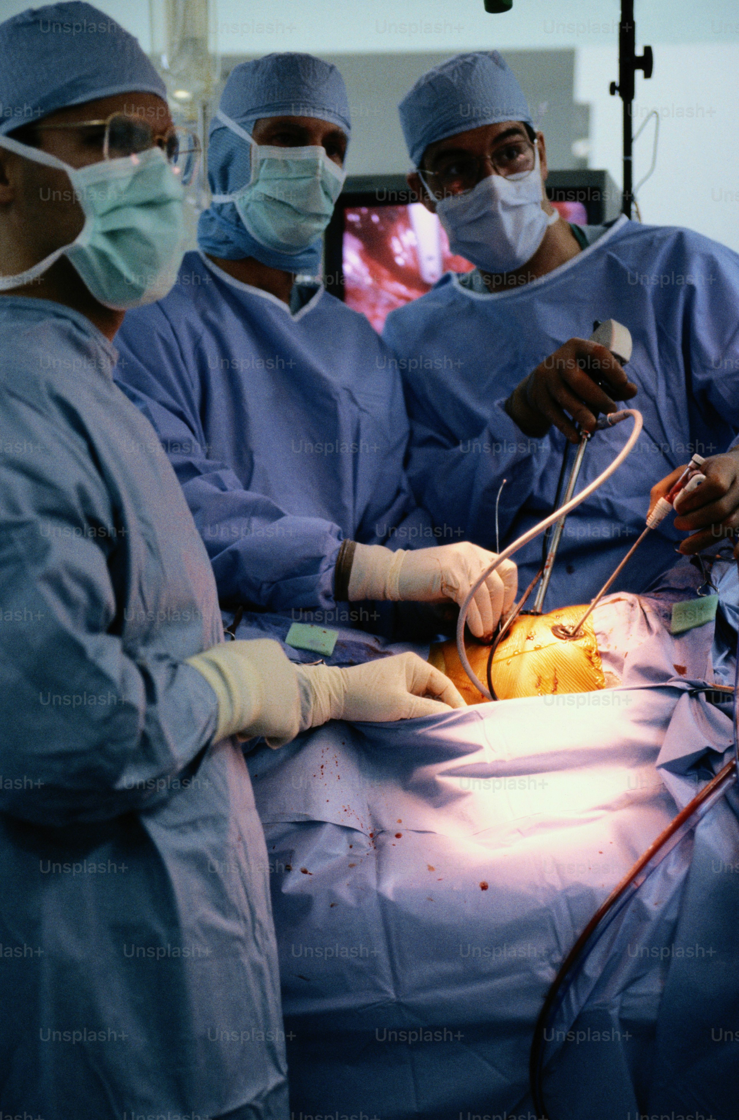 A group of doctors performing surgery on a patient photo – Indoors ...
