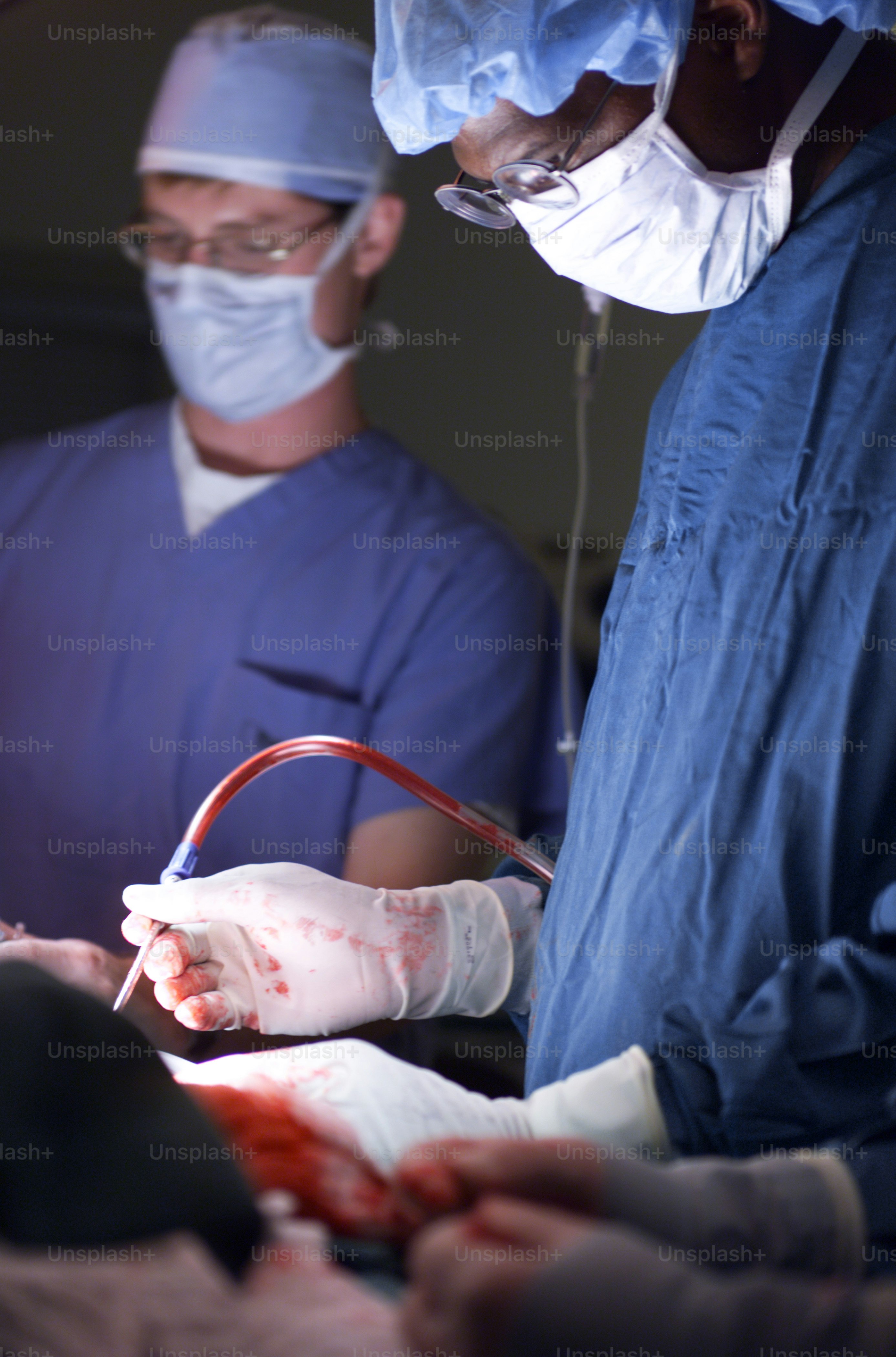 A group of doctors performing surgery on a patient photo – People Image ...