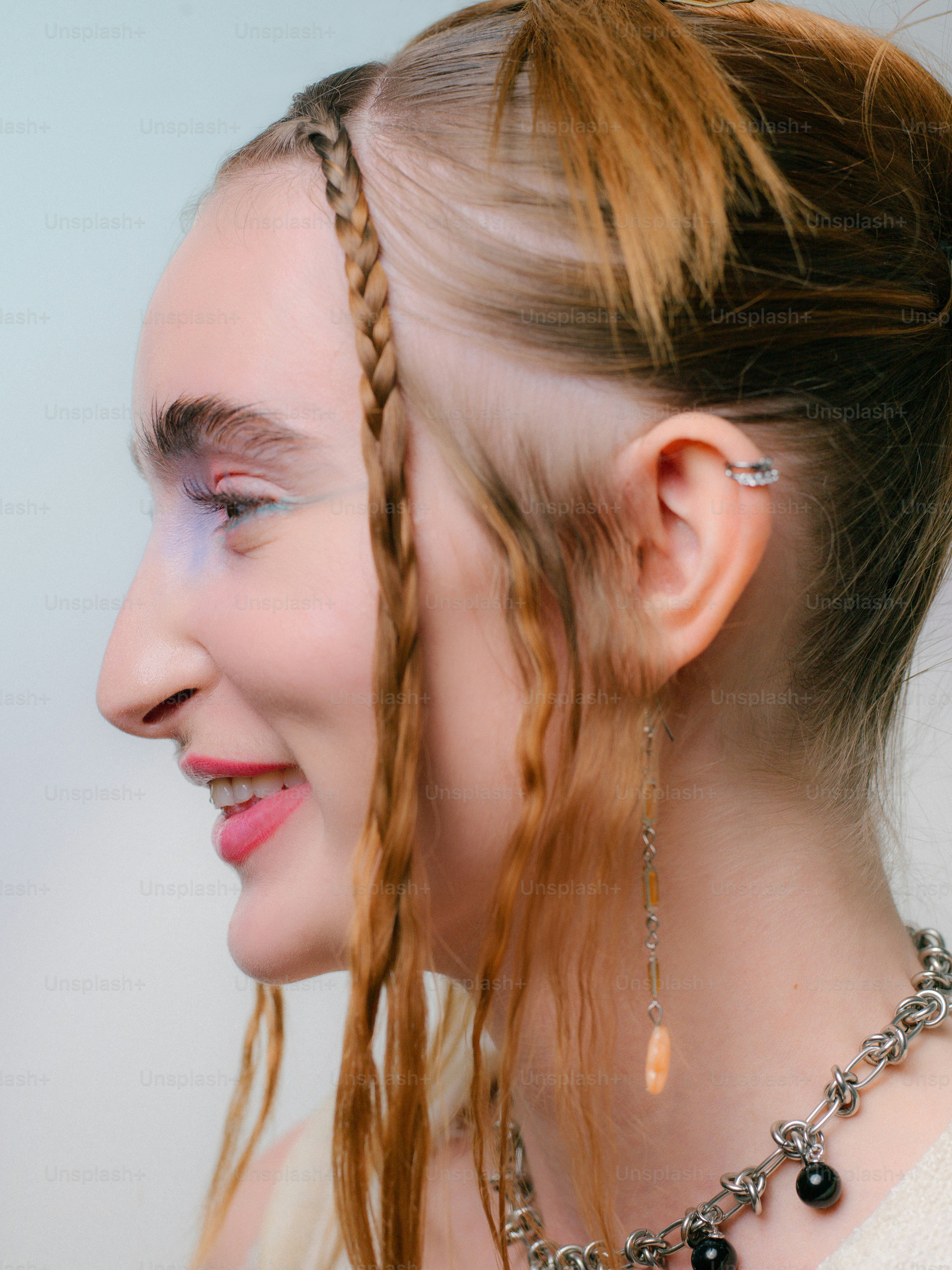 A close up of a woman with acne on her face photo – Pimple Image on ...