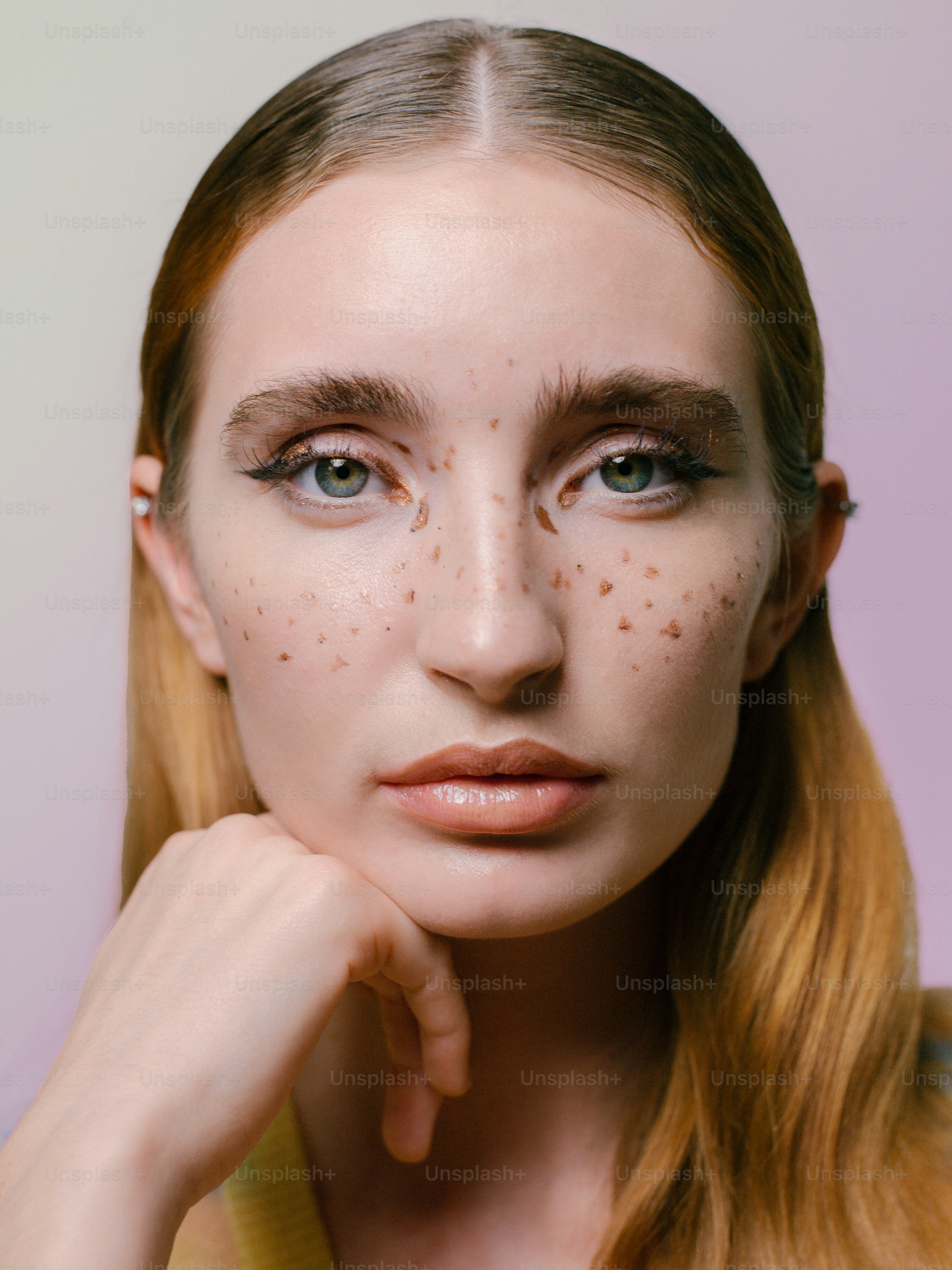 A close up of a woman with acne on her face photo – Pimple Image on ...