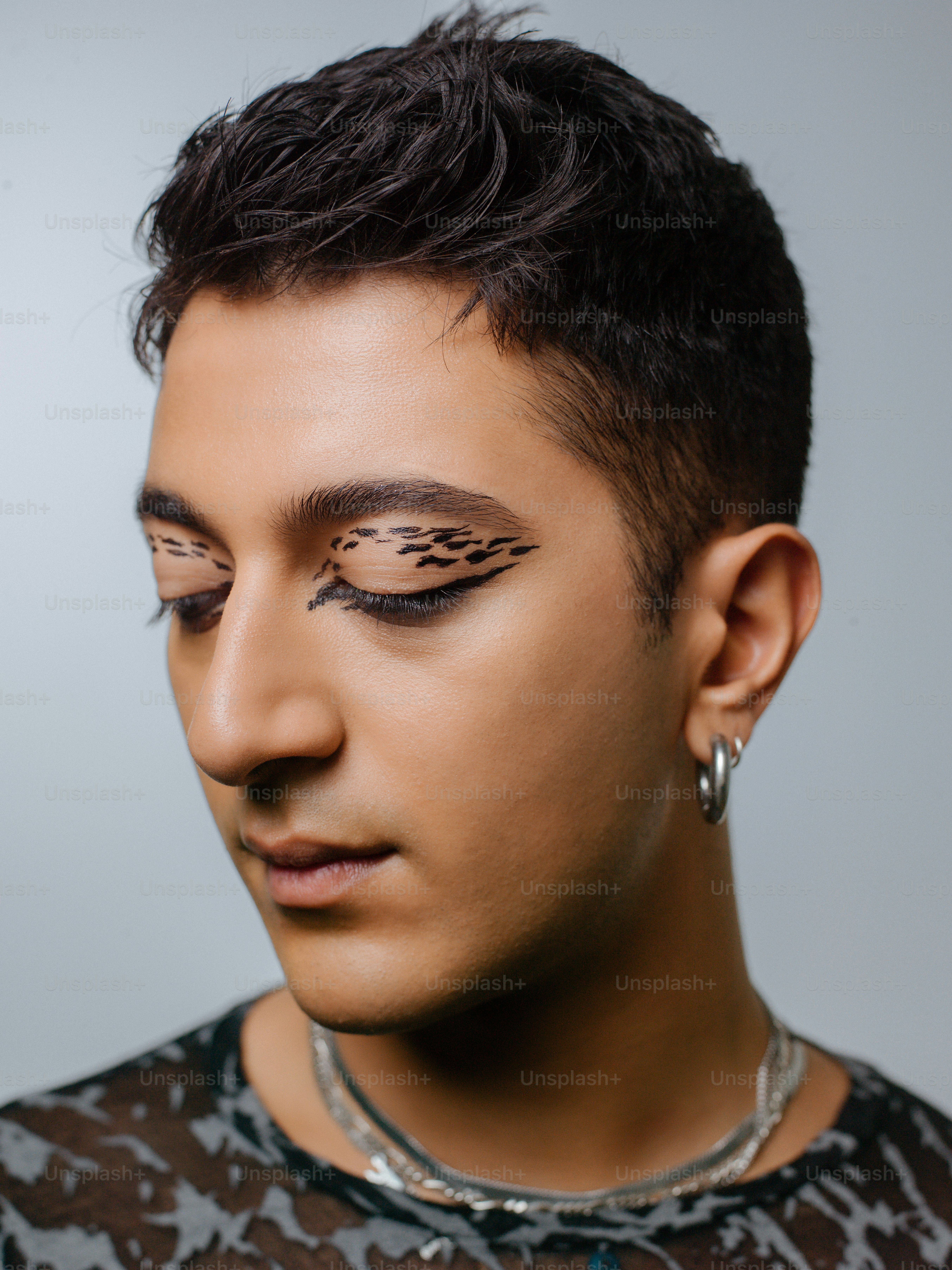 A close up of a woman with acne on her face photo – Pimple Image on ...