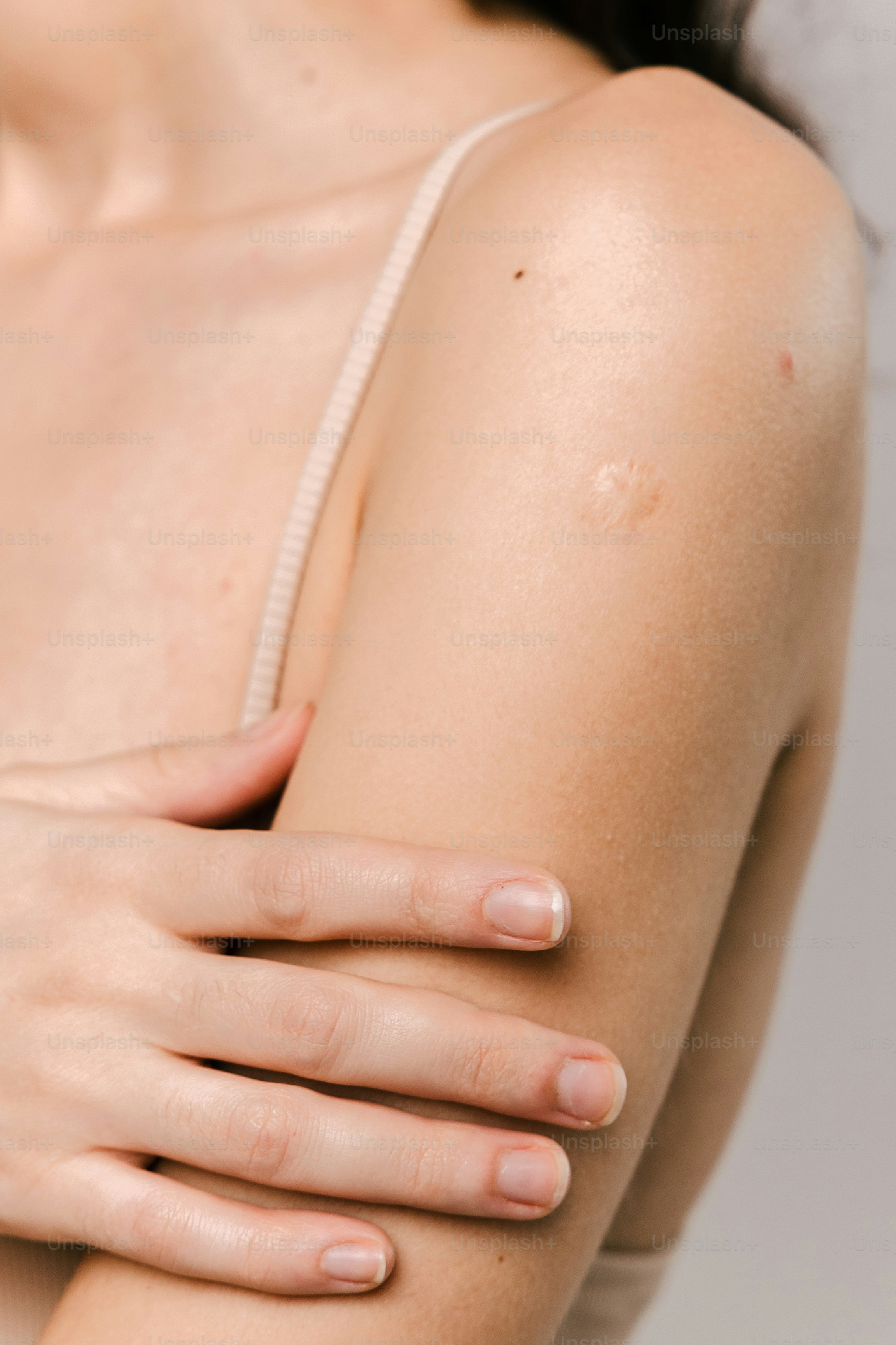 A woman with her arm wrapped around her shoulder photo – Skin Image on ...