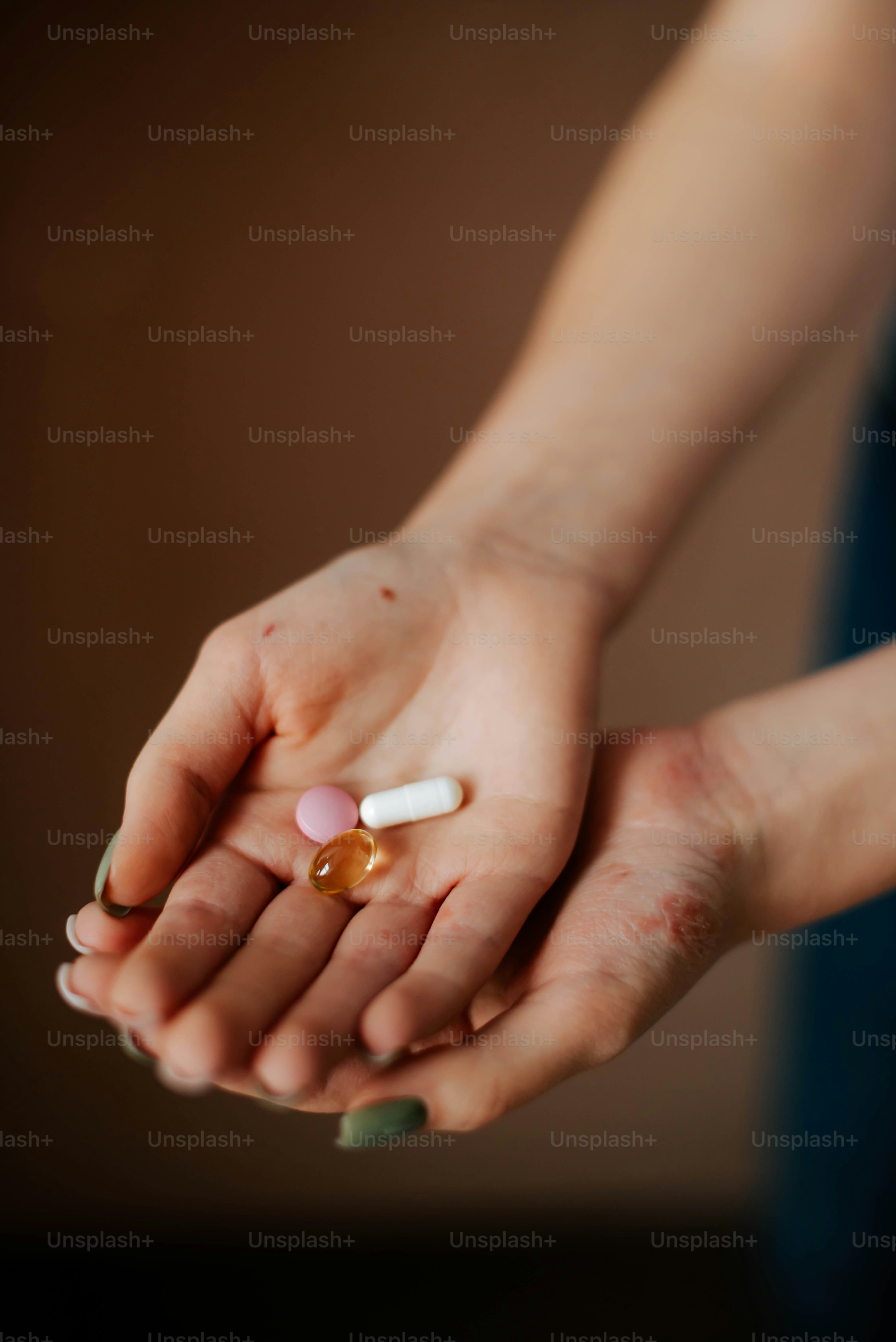 A woman's hands holding a pill and a bottle of pills photo – Healthcare ...