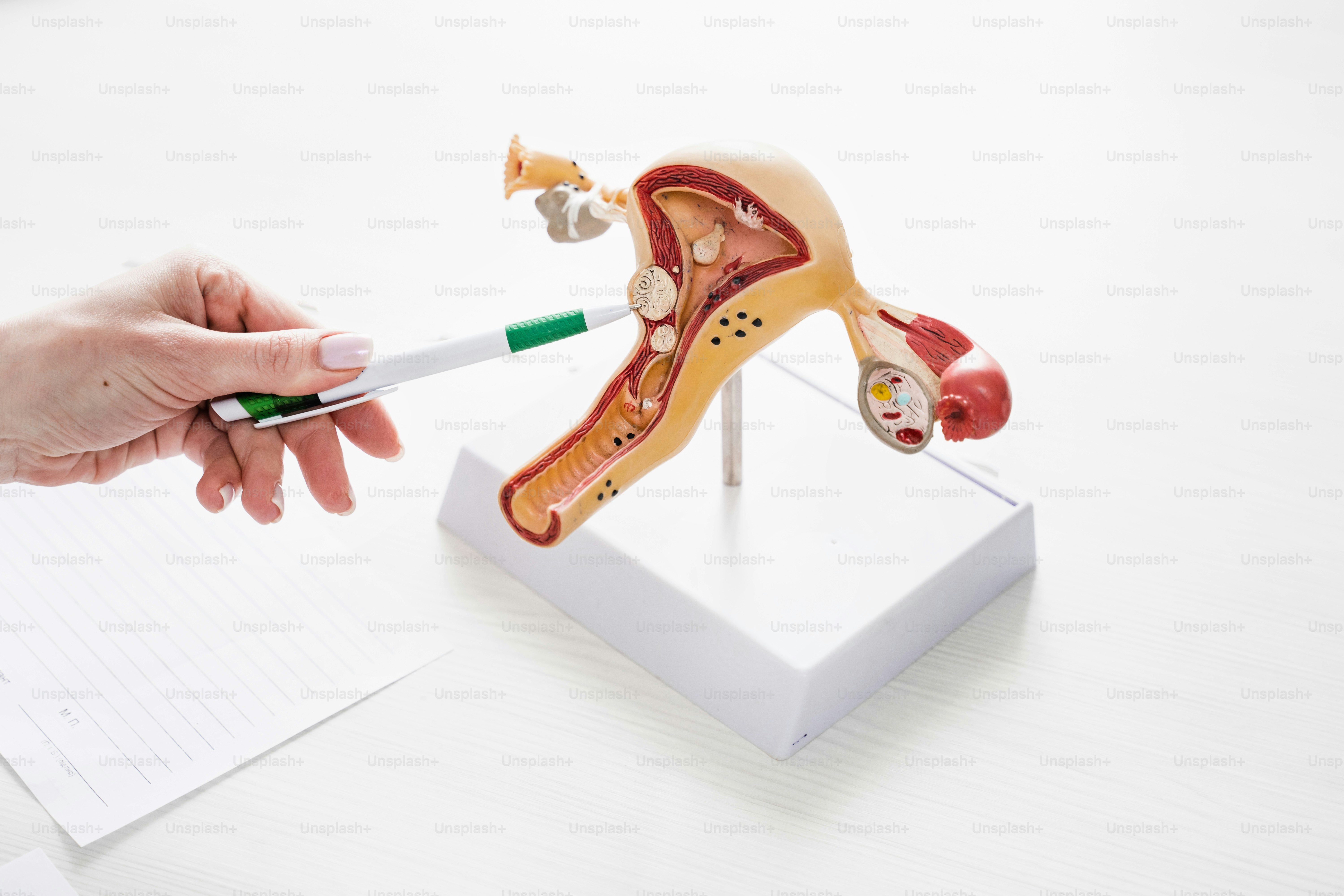 Realistic uterus model on white background close-up. Consultation with ...