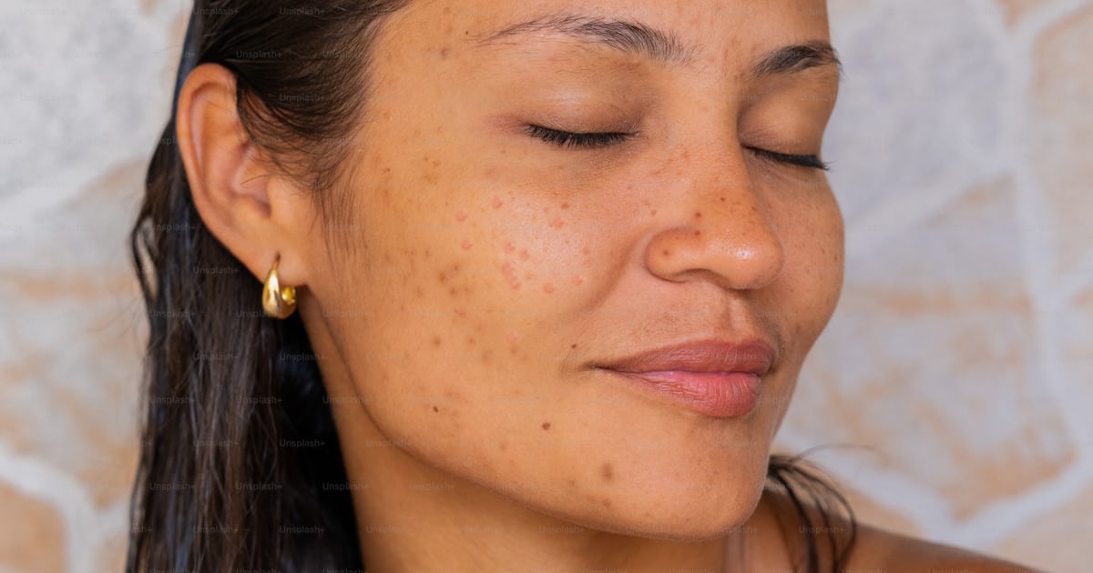 Una Mujer Con Pecas En La Cara Y Los Ojos Cerrados Foto Imagen De