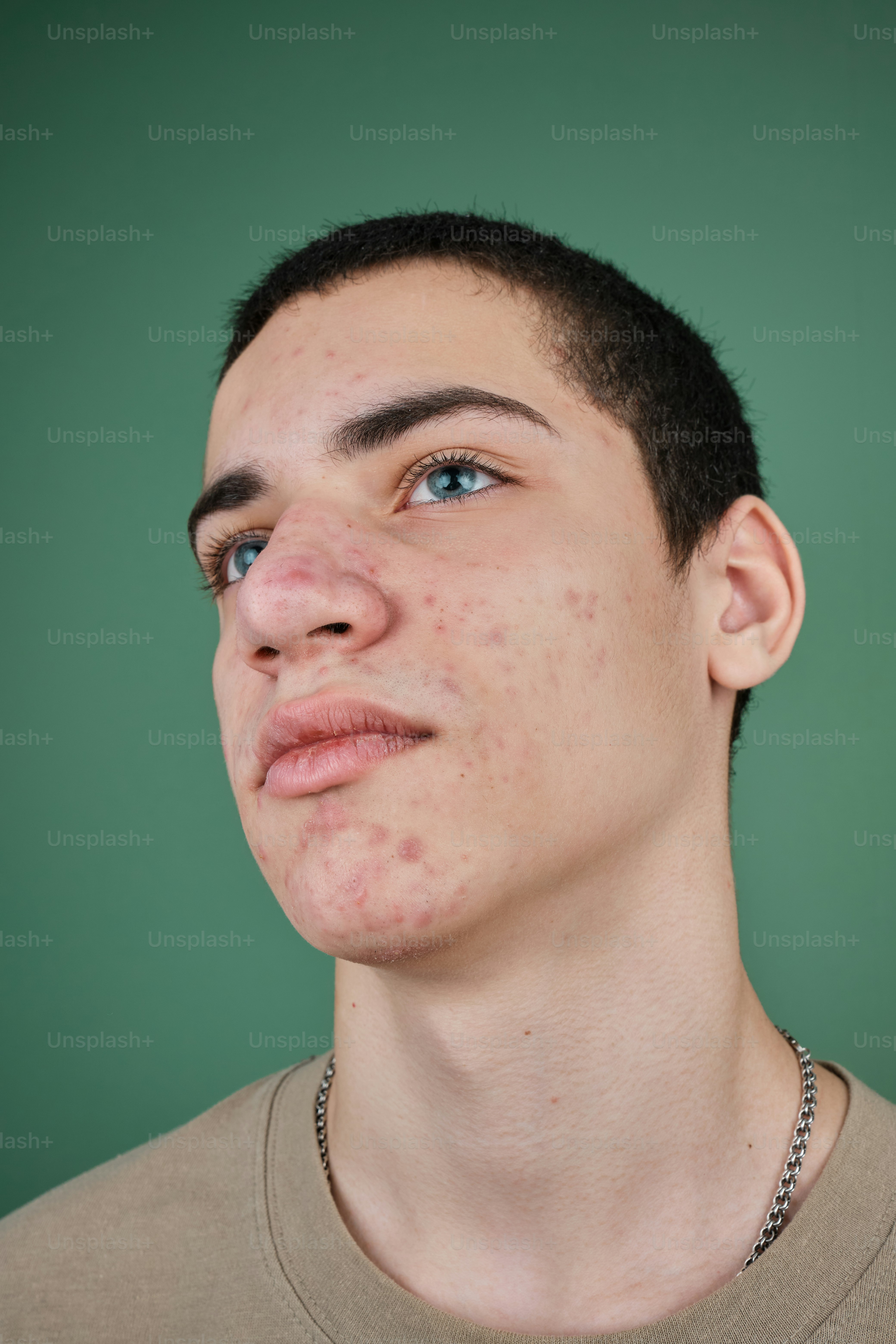 Face Pimple Pictures | Download Free Images on Unsplash