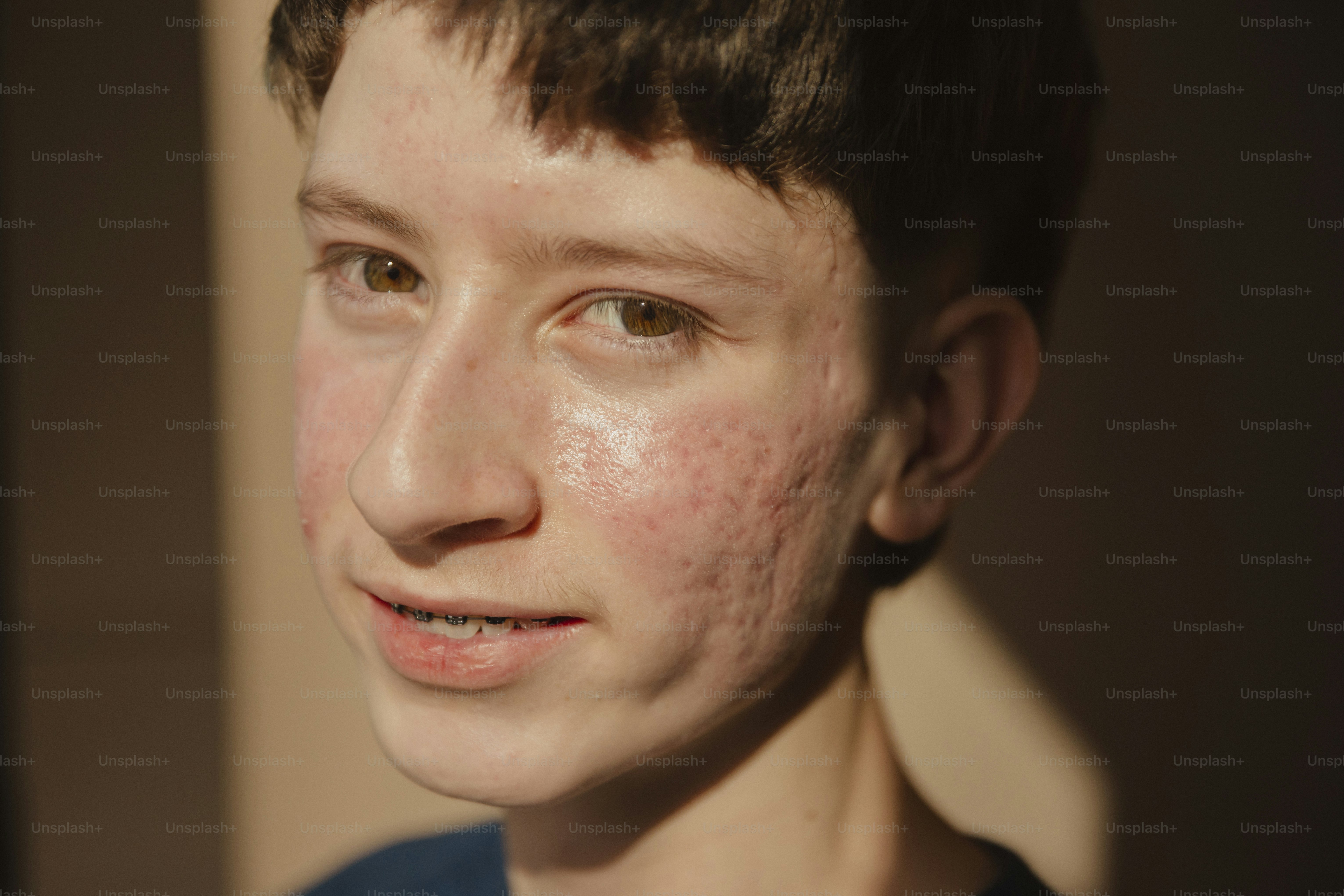 A close up of a person with freckles on their face photo – Face Image ...