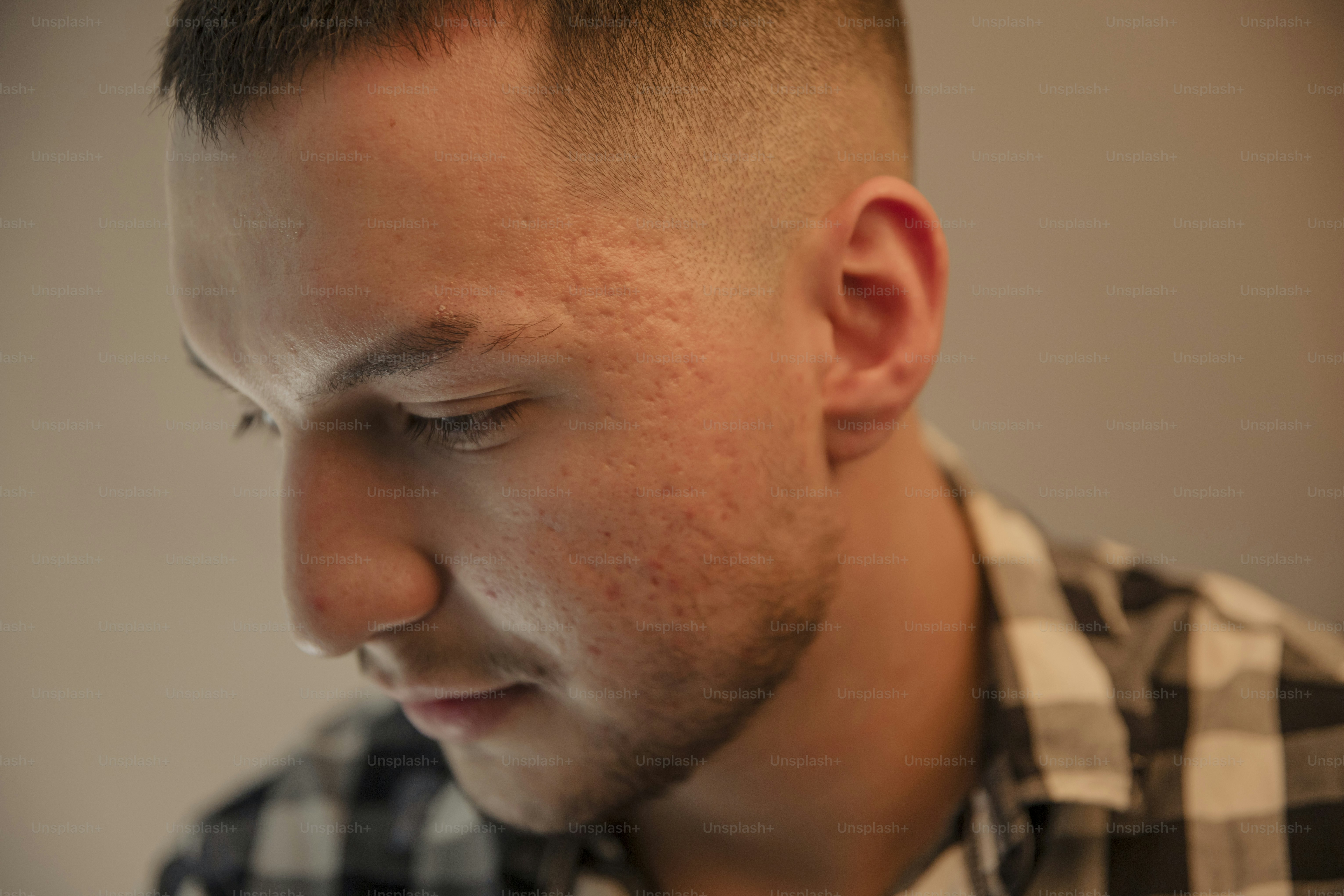 A close up of a man with freckles on his face photo – Face Image on ...