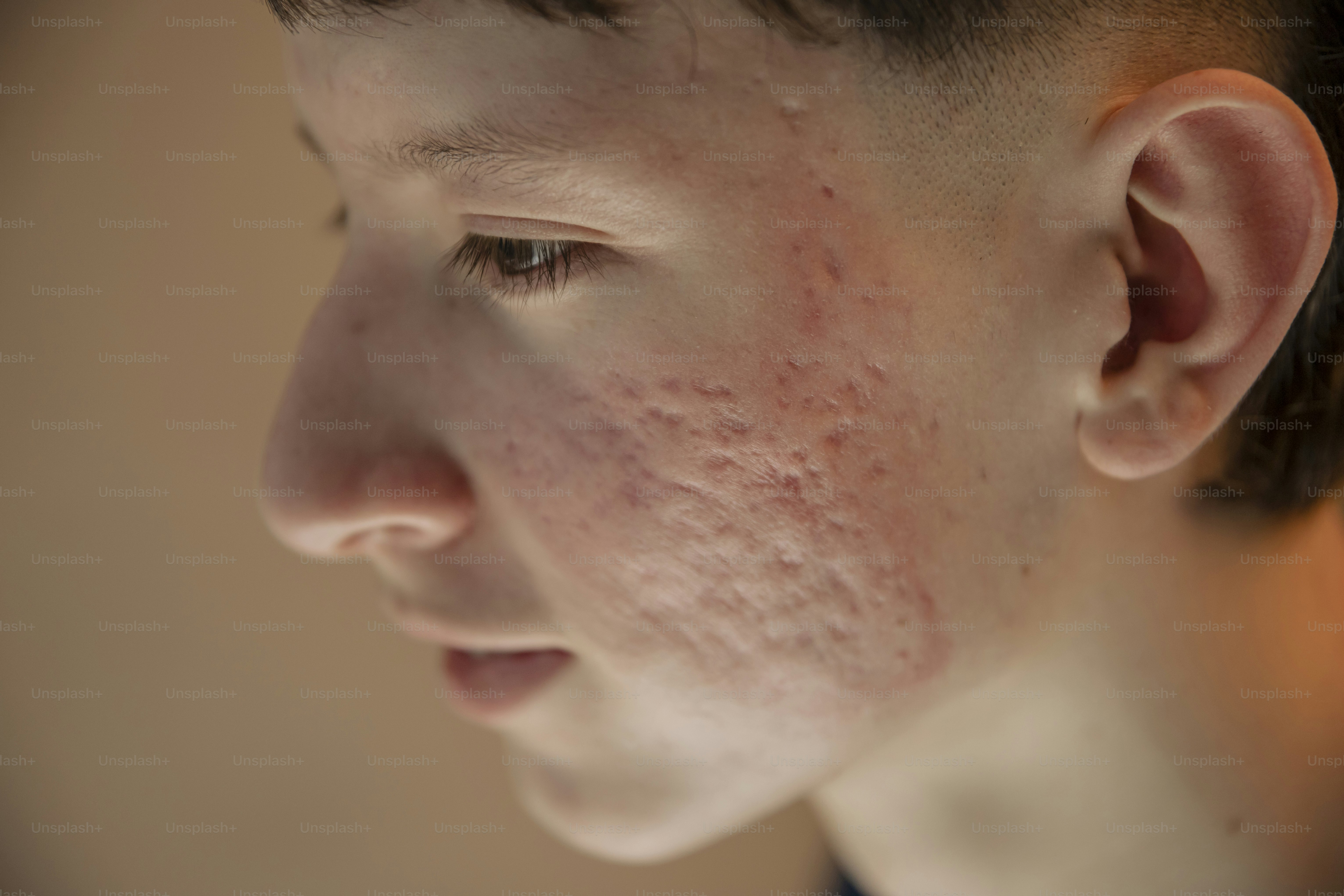 A close up of a person with freckles on their face photo – Spots Image ...