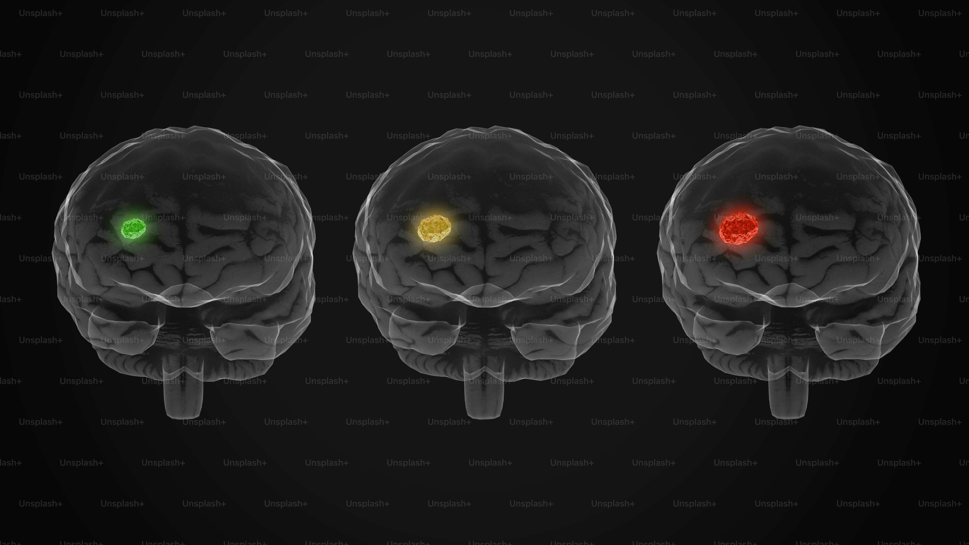 Three different areas of the brain with different colored areas photo ...