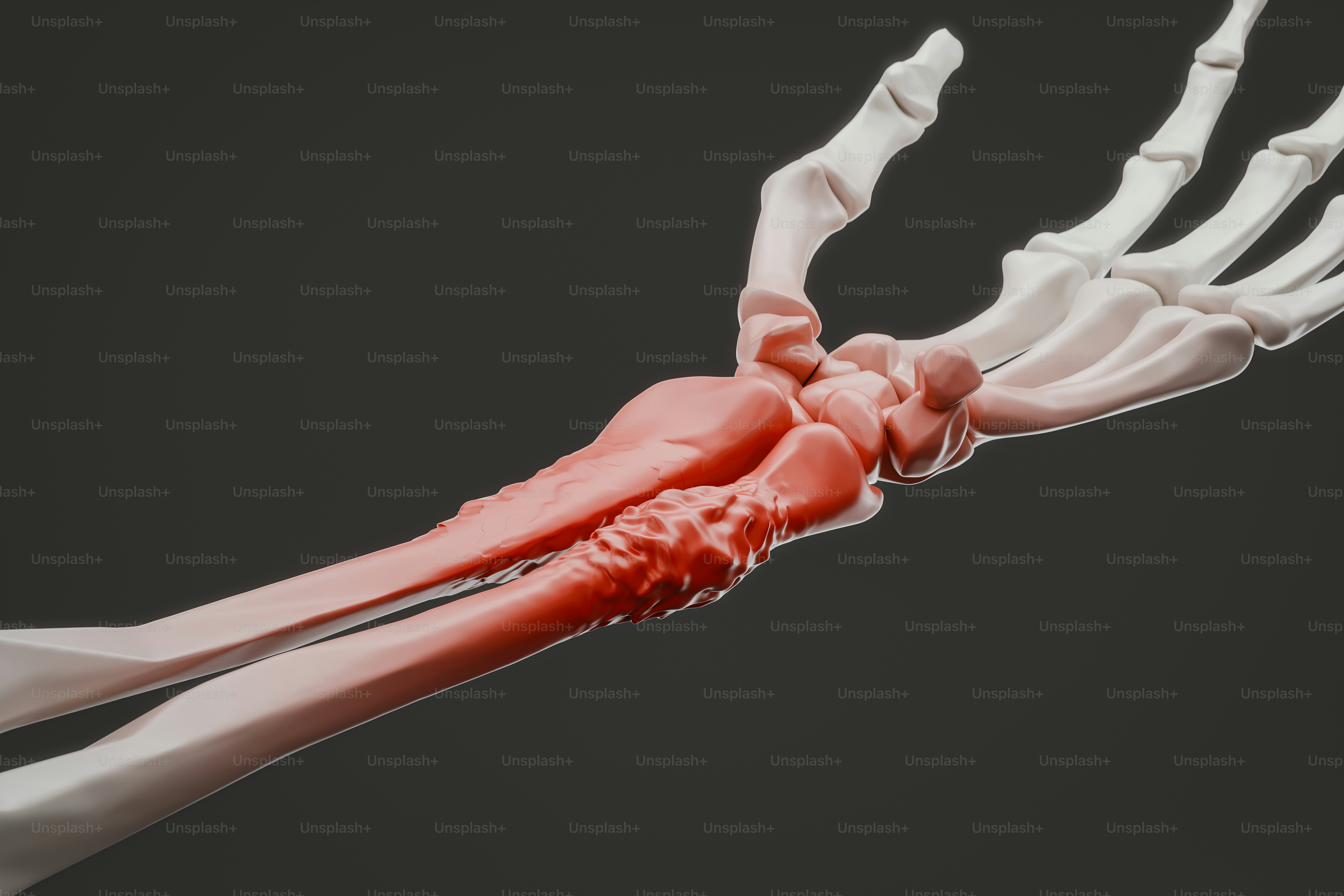 A picture of a skeleton's arm and arm bones photo – Cancer Image on ...