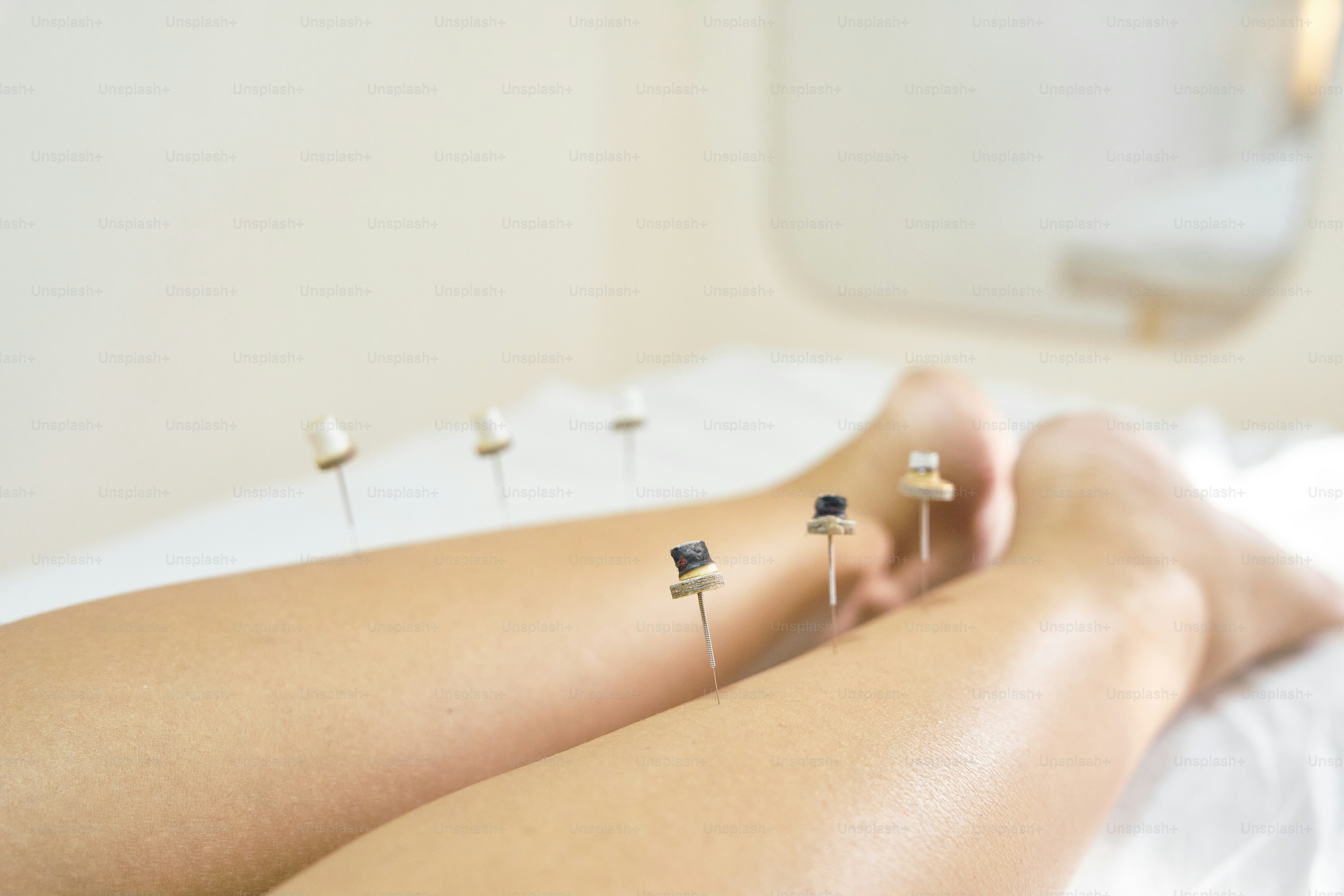 A woman laying on a bed with three pins on her legs photo – Medicine ...