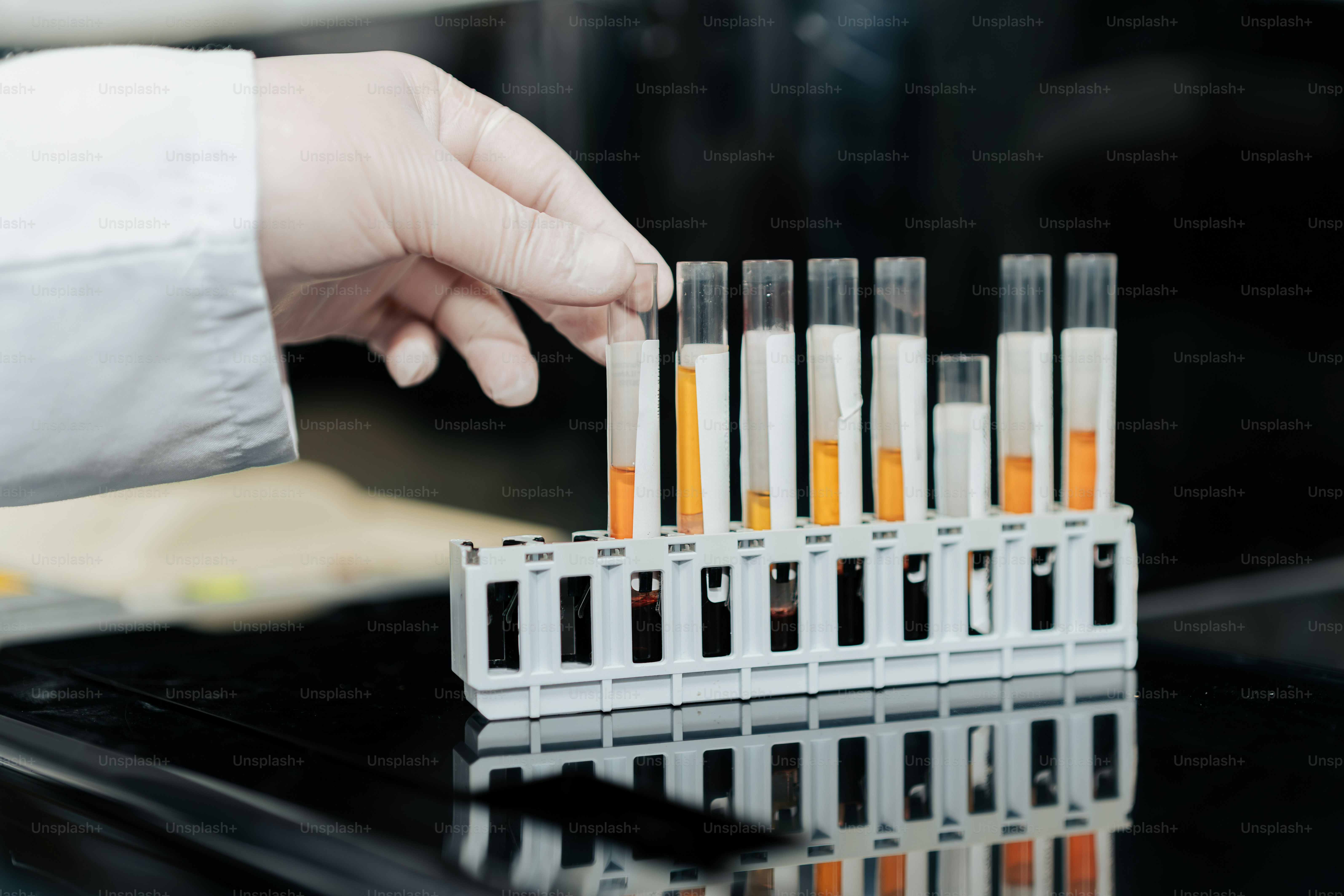 A person holding a test tube filled with orange liquid photo – Blood ...