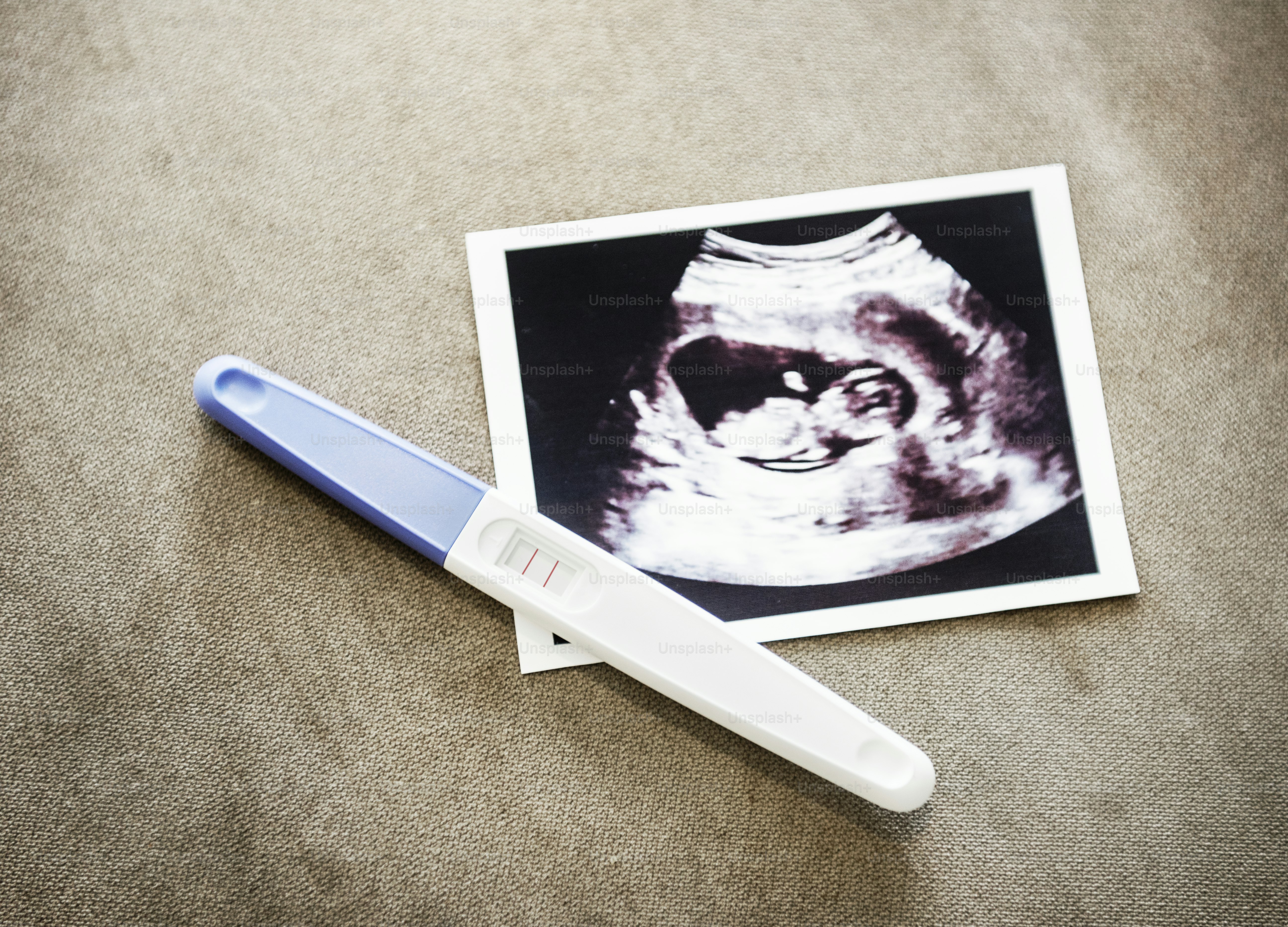 Baby ultrasound scan photo with pregnancy test photo – Newborn Image on ...