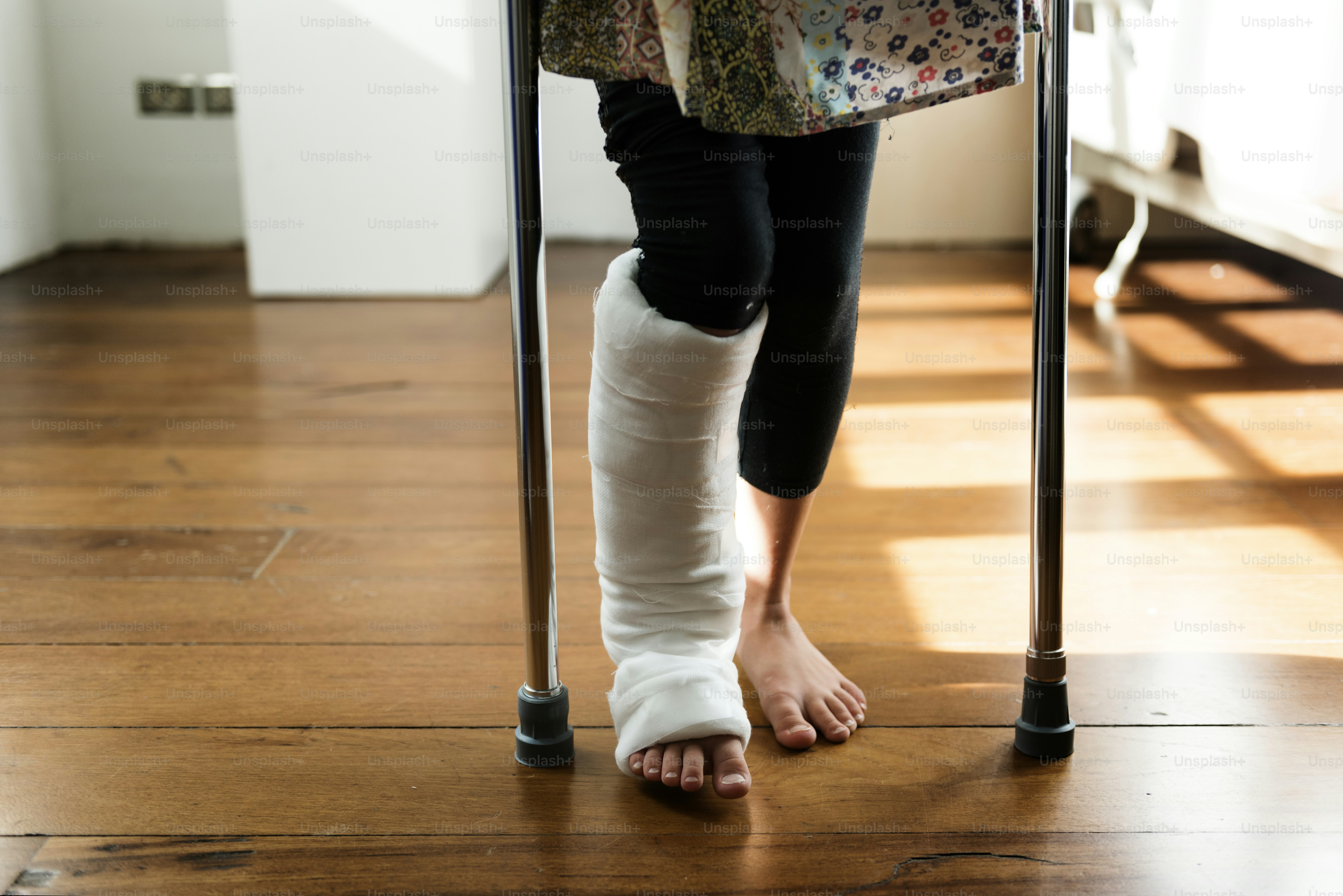 Broken Leg Pictures | Download Free Images on Unsplash