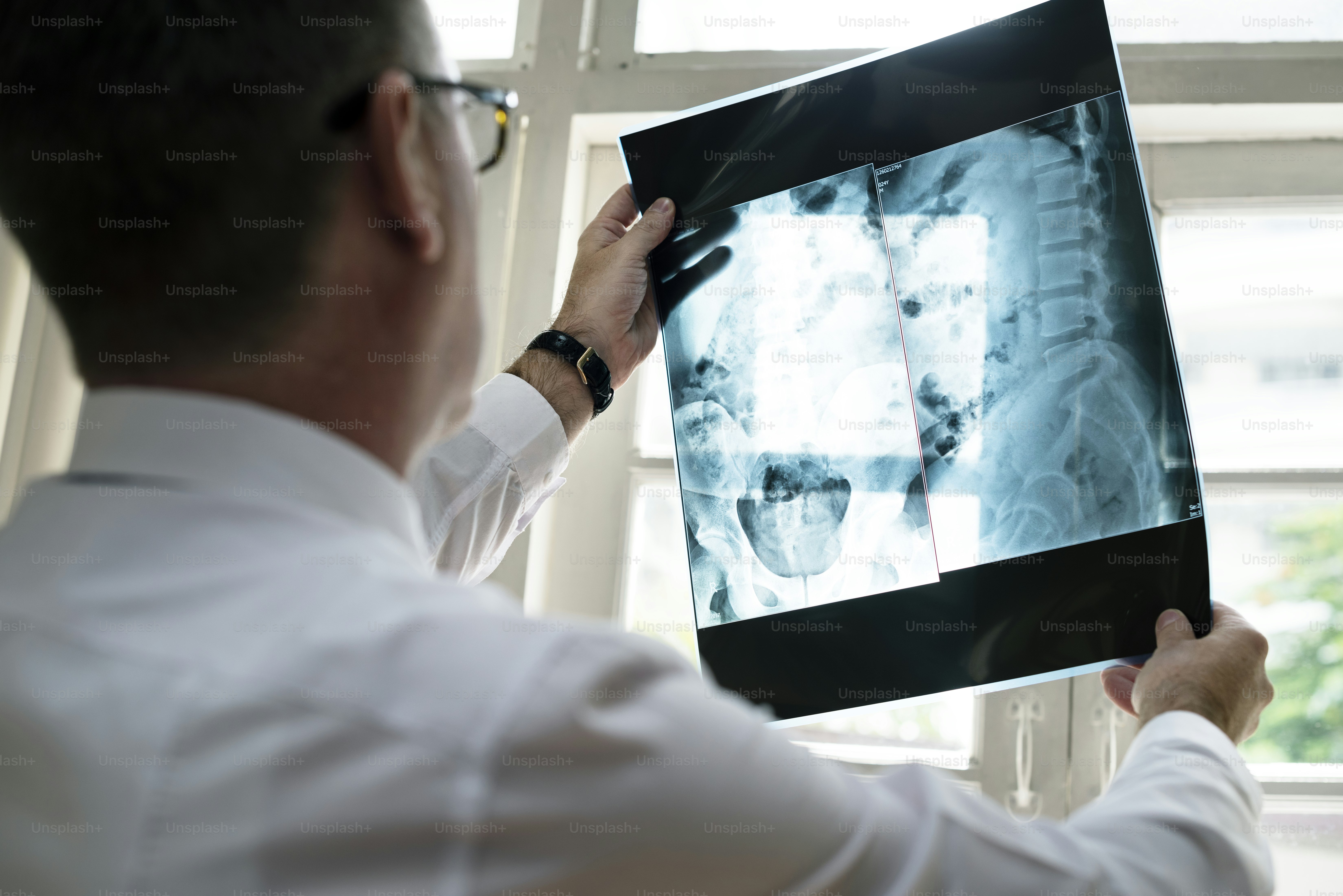 Doctor is checking patient x-ray film photo – The human body Image on Unsplash