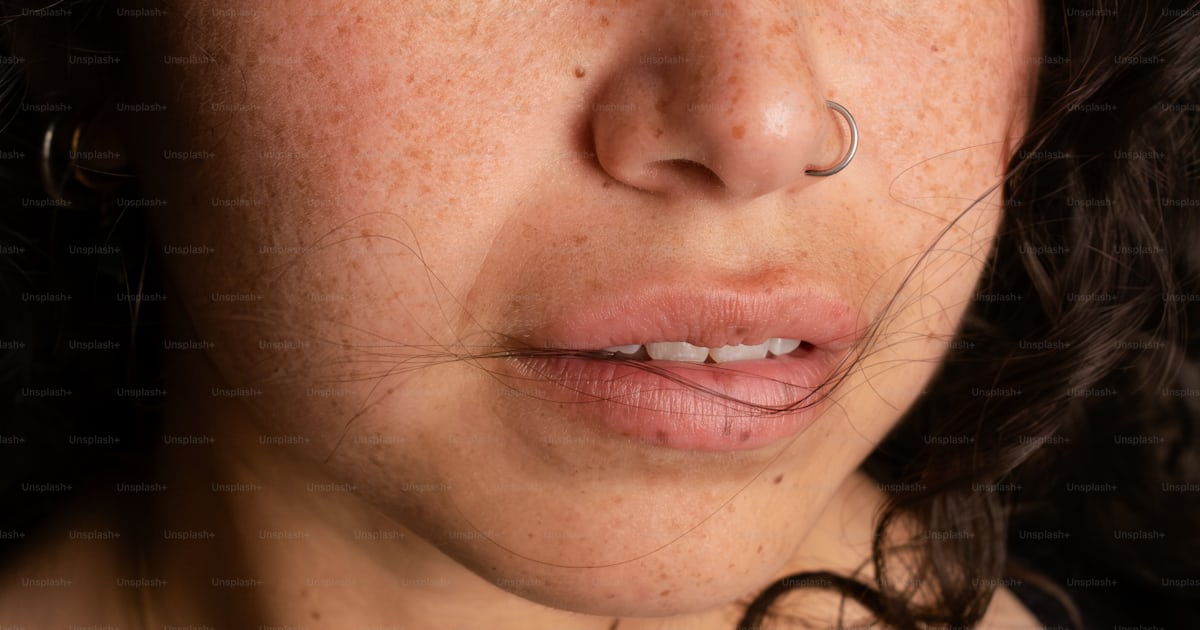 Un Primer Plano De Una Mujer Con Pecas En La Cara Foto Imagen De