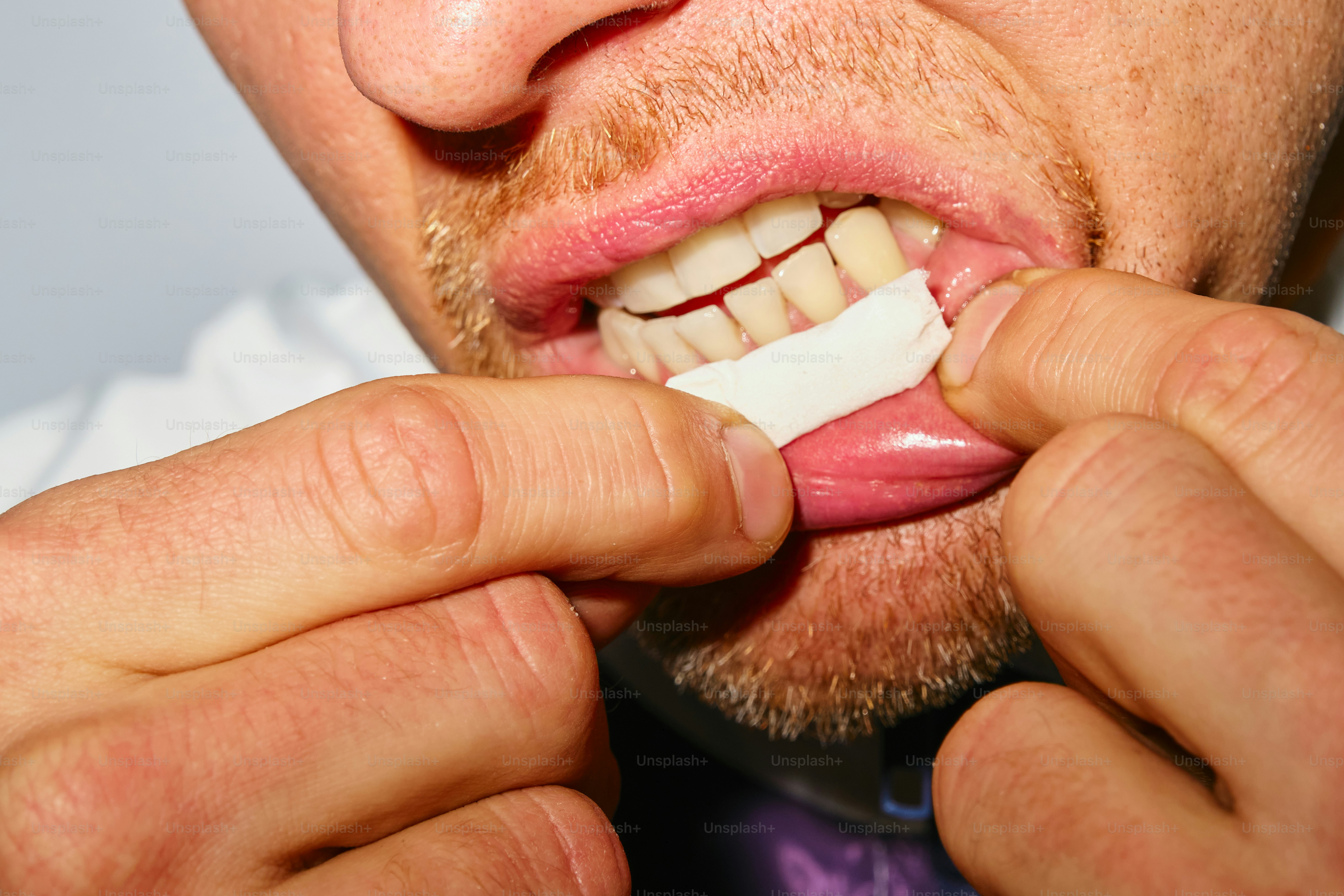 Someone is putting a teeth whitening strip on. photo – Snus Image on ...