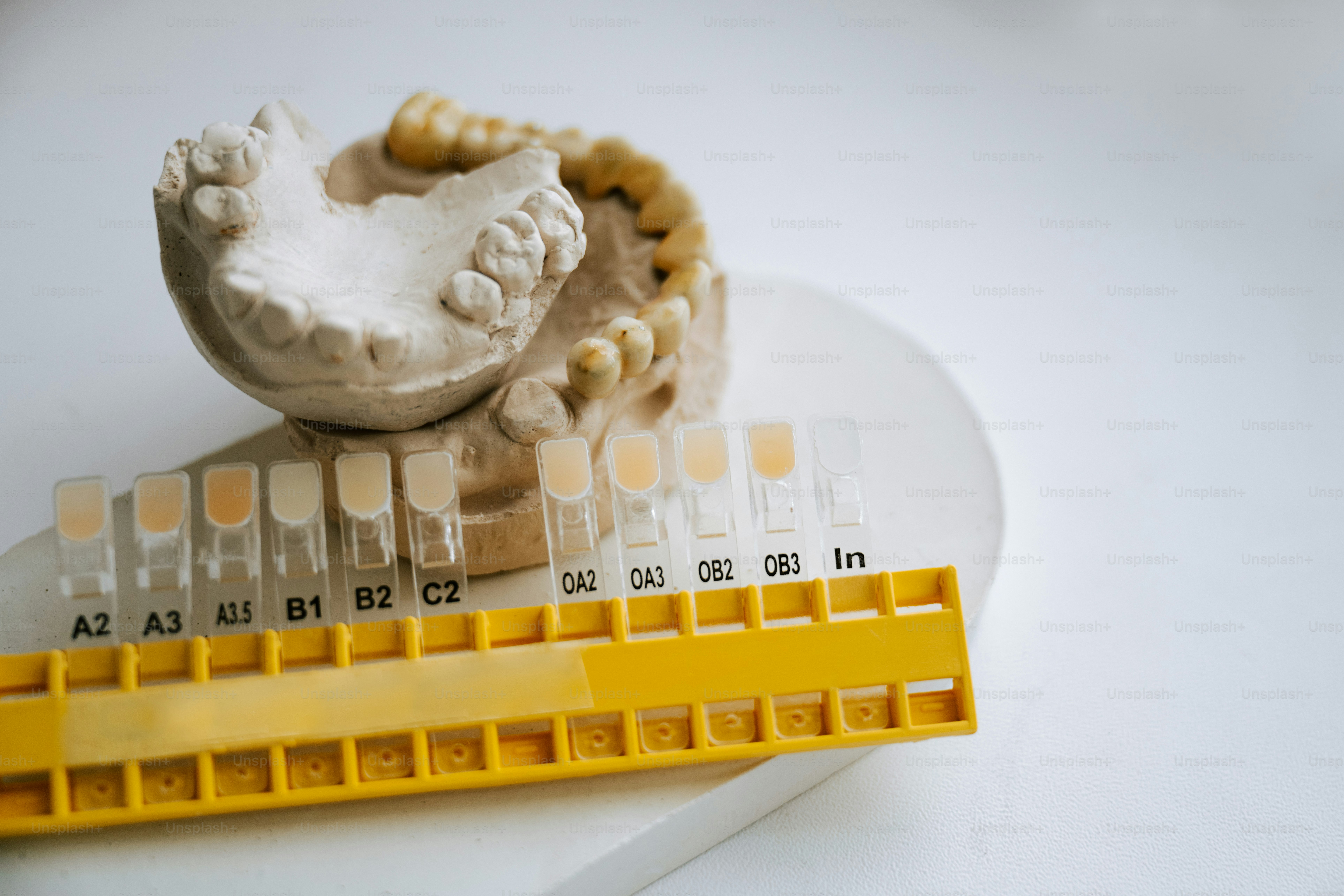 Guide de teinte dentaire à côté d’un modèle de dents. photo – Image de ...