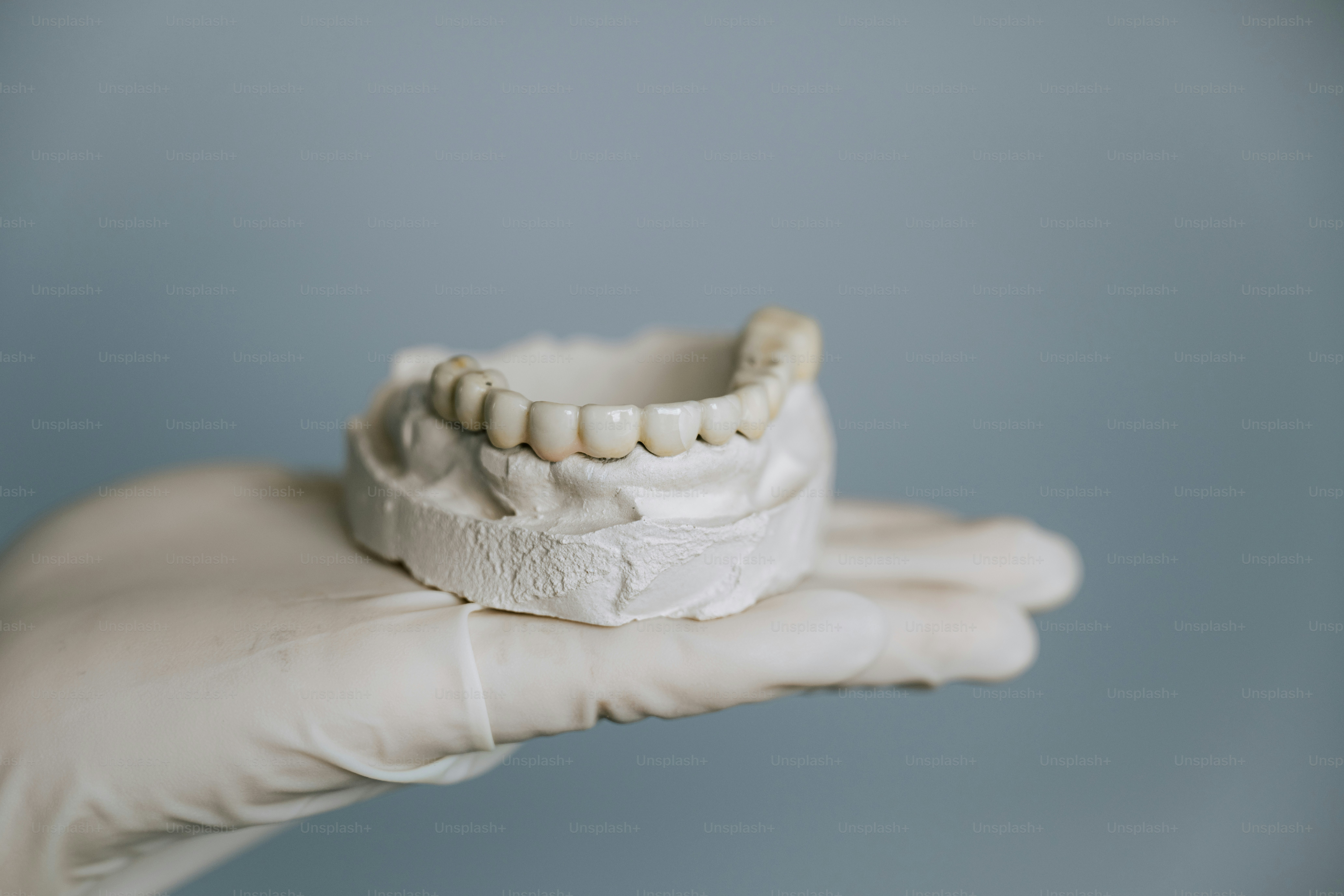 A dental impression is held by a gloved hand. photo – Dental Image on ...