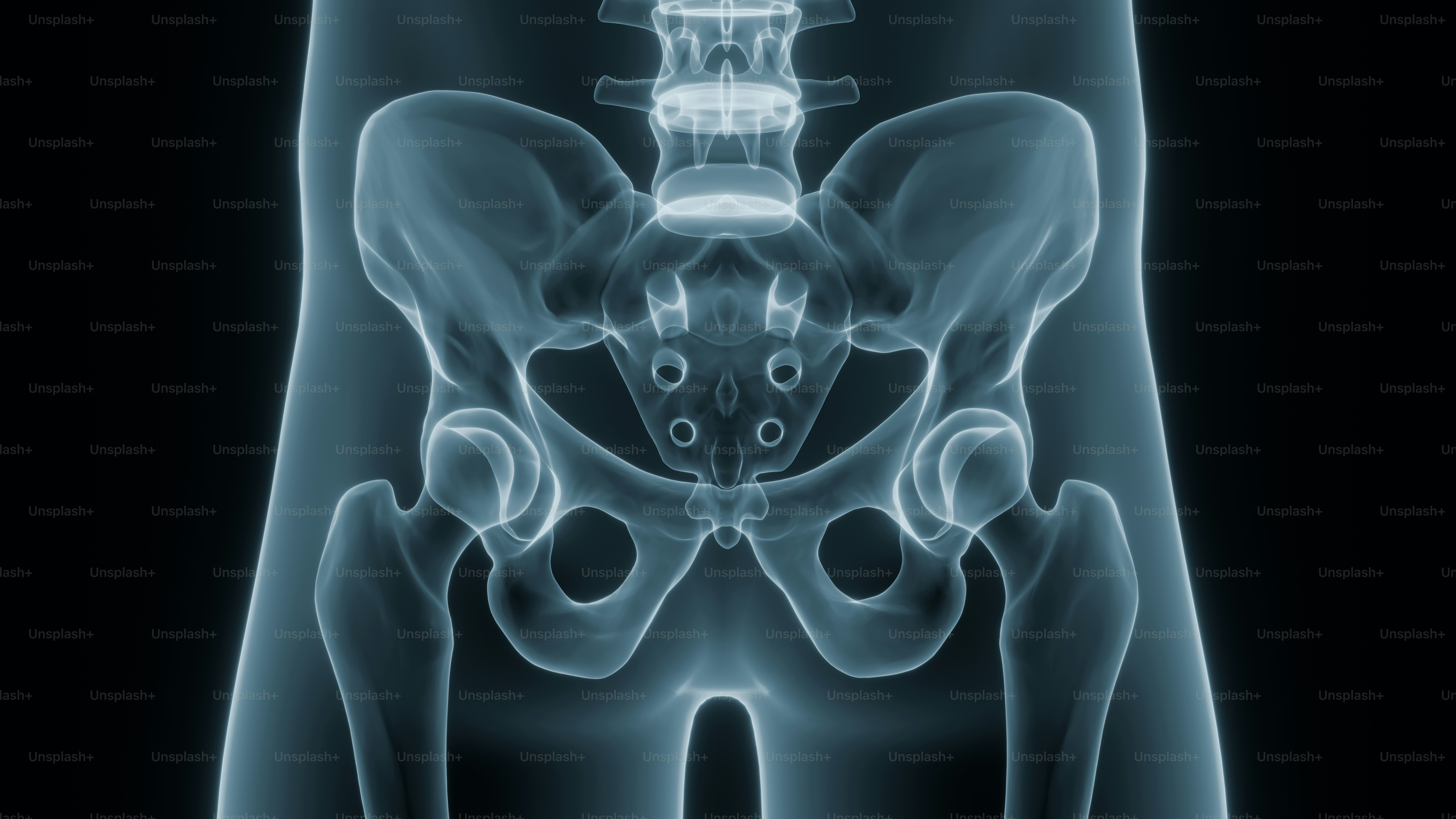 A medical x-ray shows a human torso. photo – Health Image on Unsplash