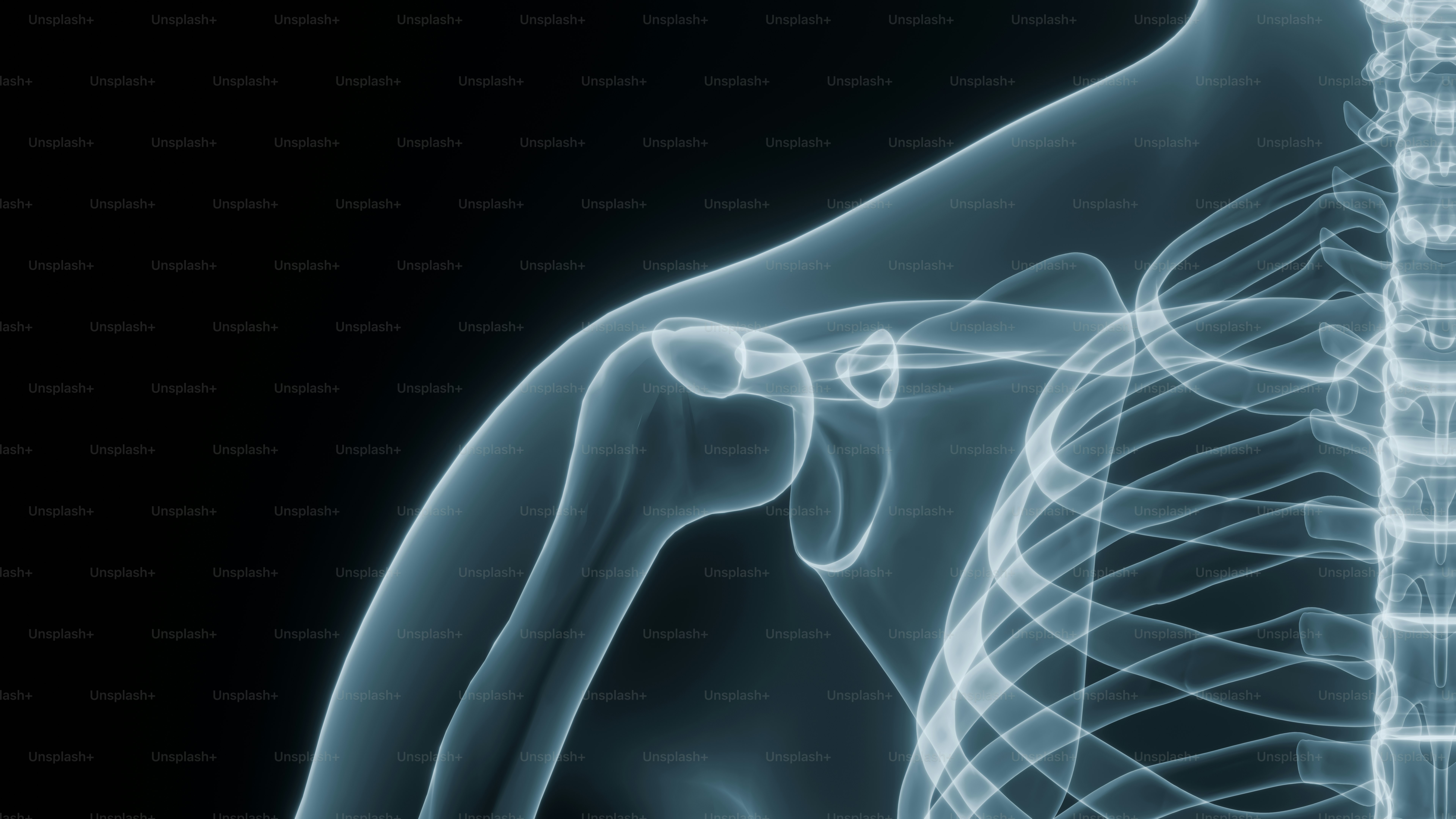 An x-ray of the shoulder and upper body. photo – Health Image on Unsplash