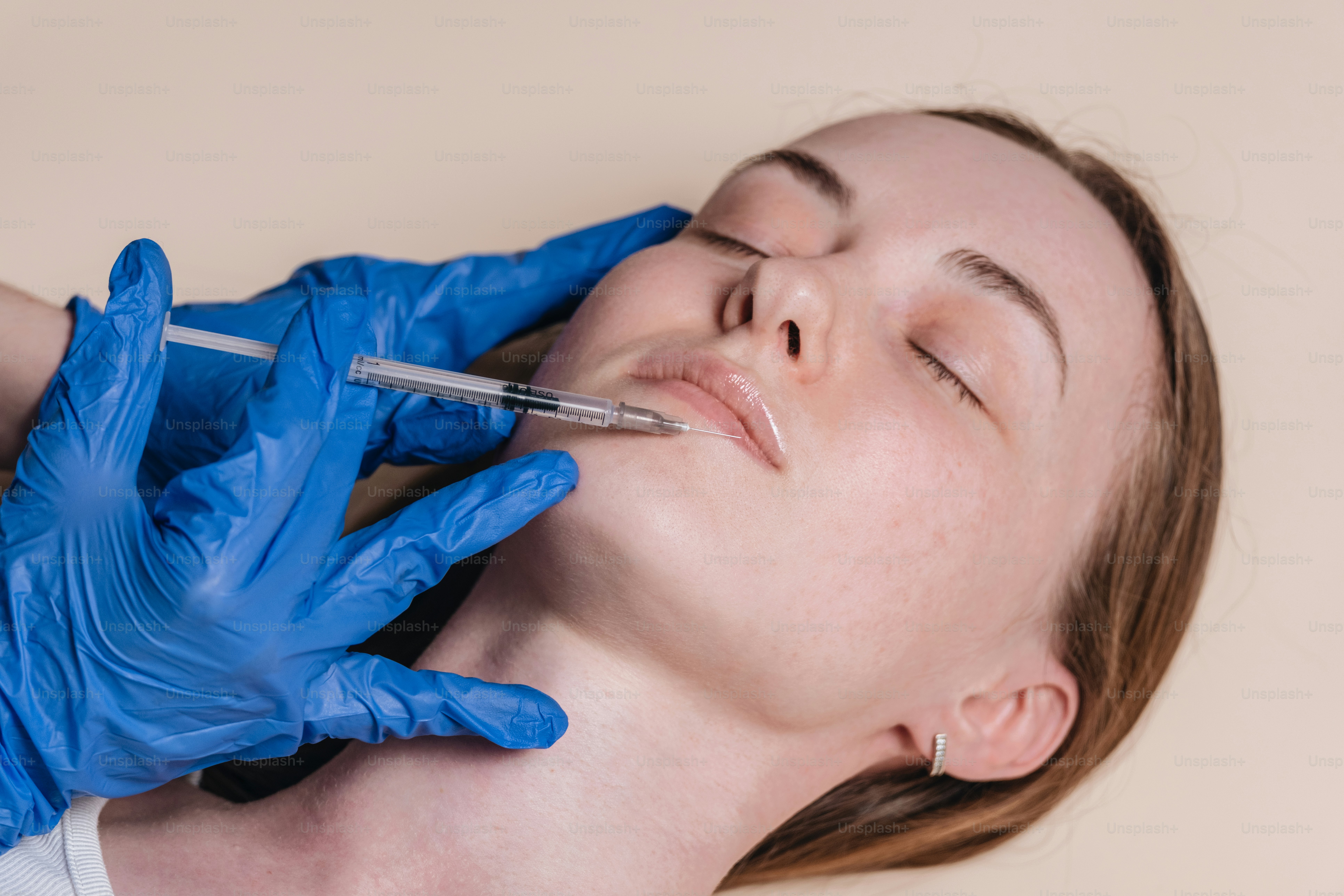 Someone is receiving lip injections. photo – Health Image on Unsplash