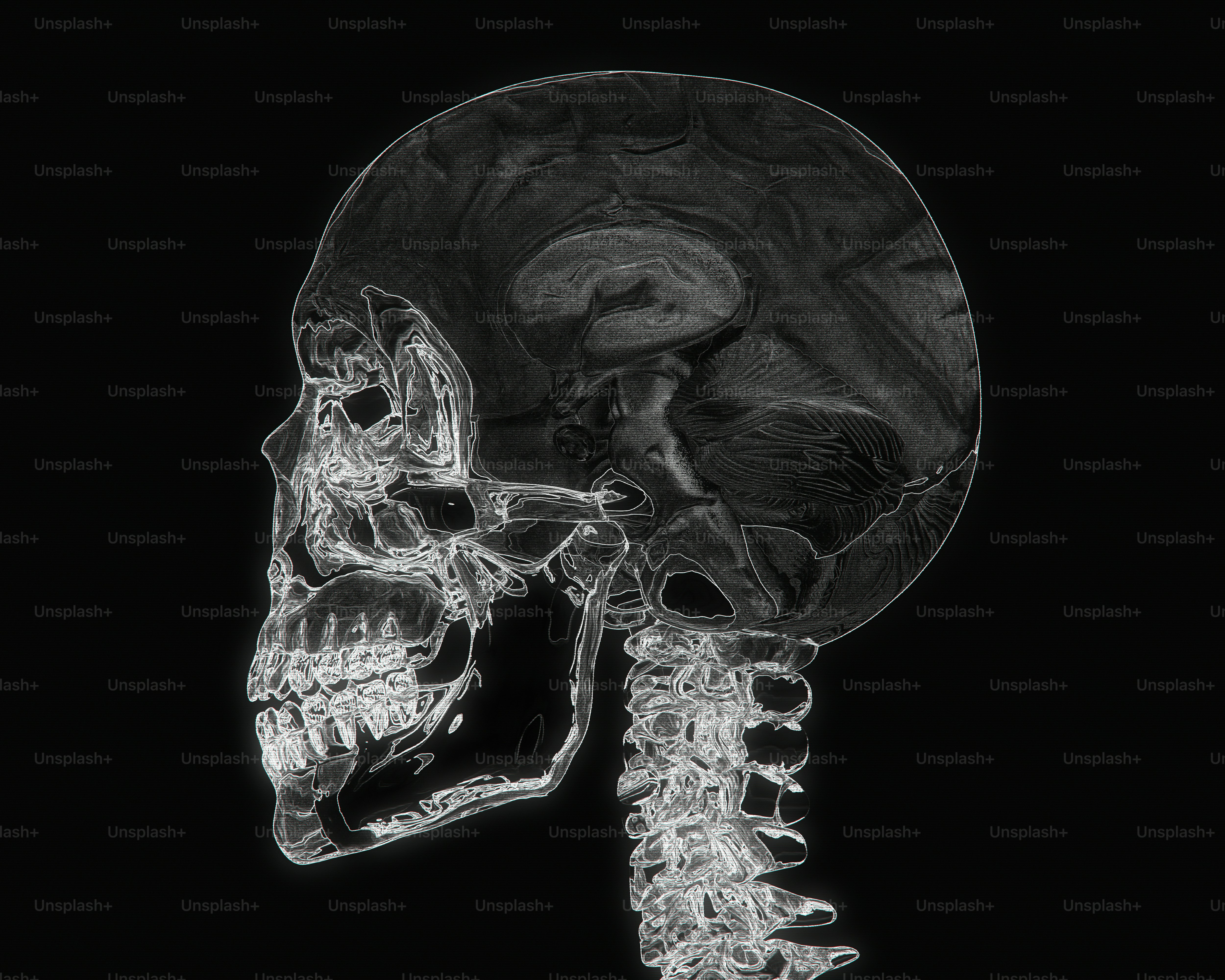 Una imagen de rayos X de vista lateral de un cráneo humano. foto ...