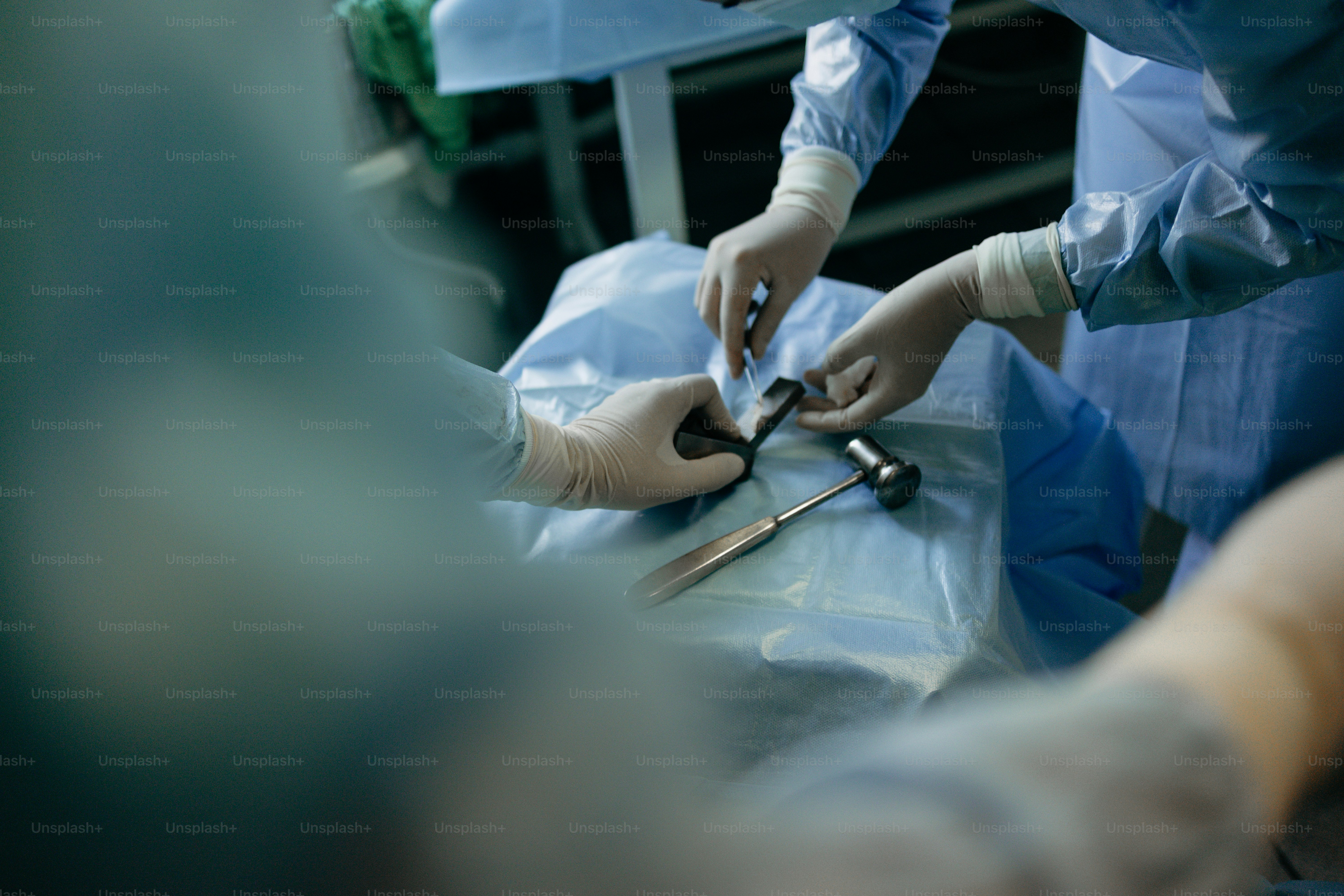 Surgeons are performing an operation in an operating room. photo ...