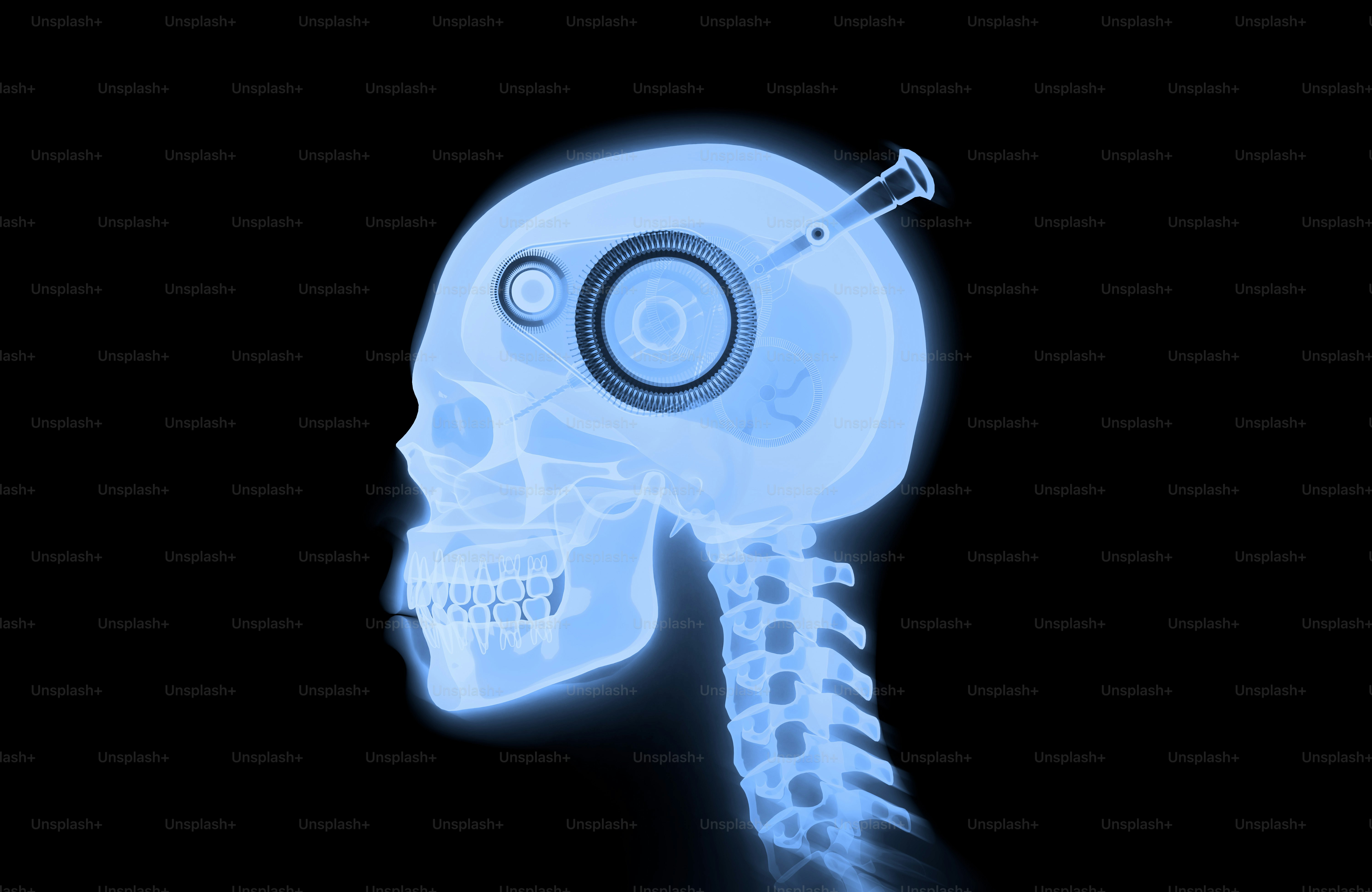 X-ray of a skull with a syringe in brain photo – Abstract Image on Unsplash