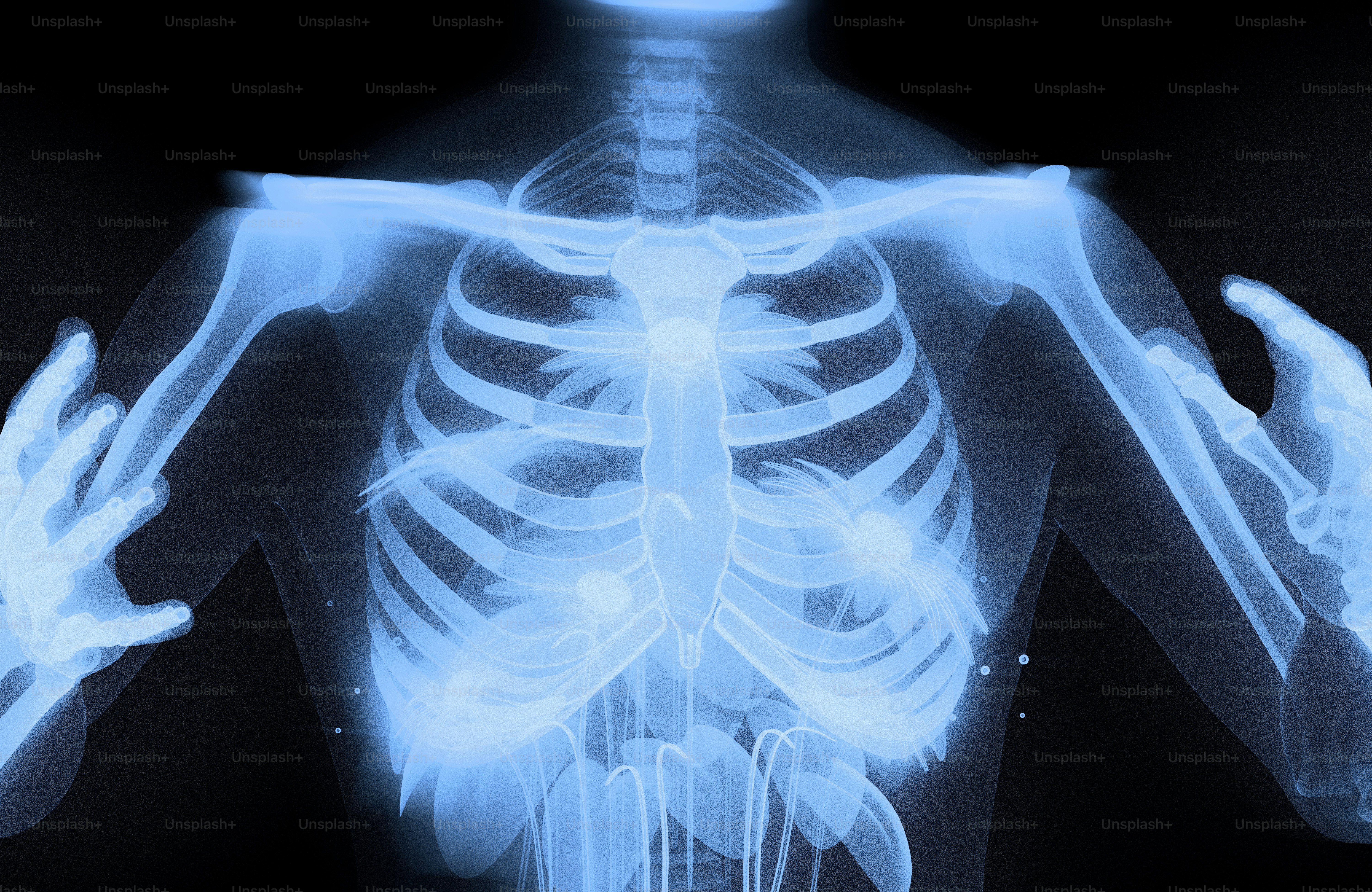 X-ray of a human torso with butterflies and flowers. photo – Flower ...