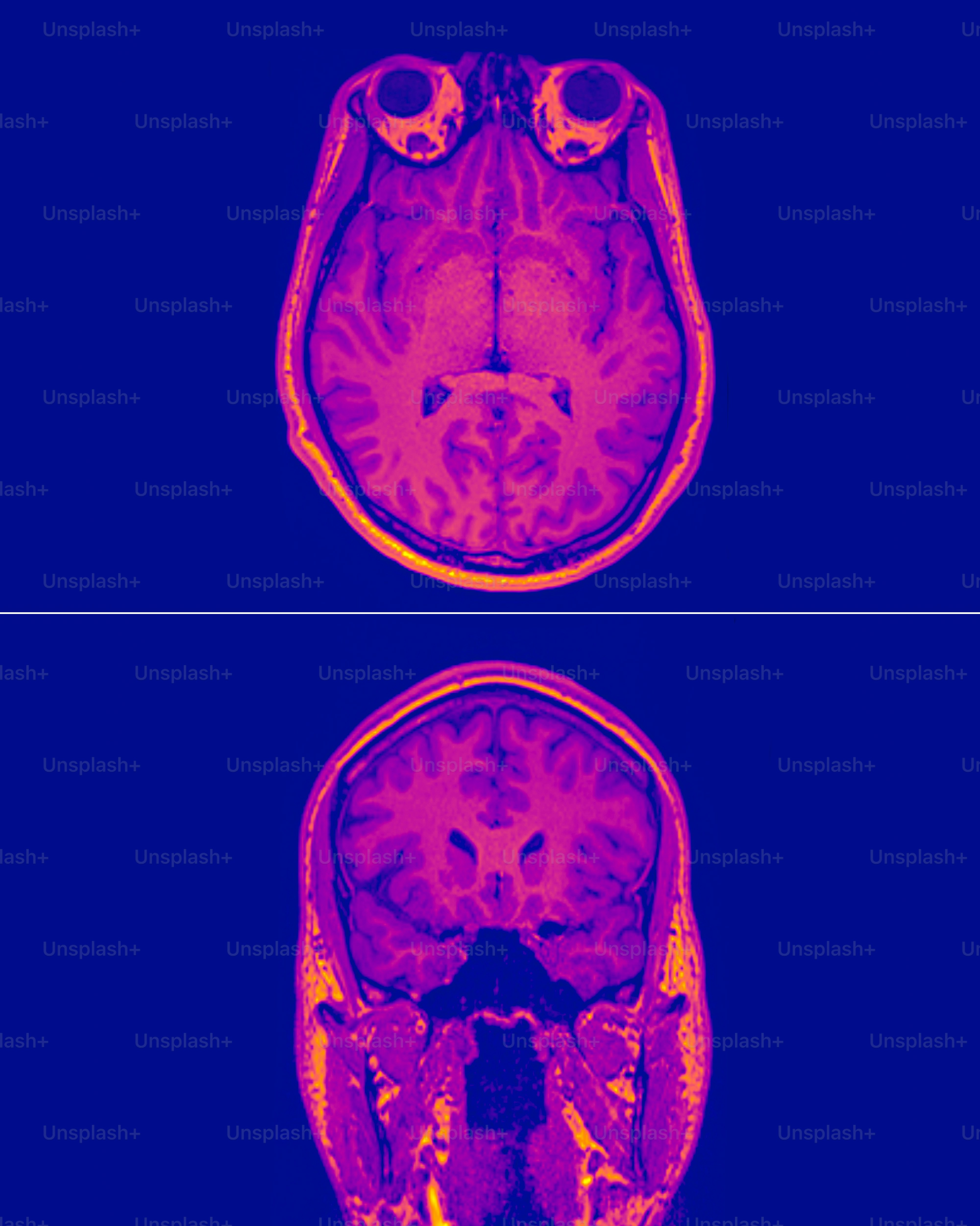 Axial and coronal brain mri scans with vibrant colors. photo ...