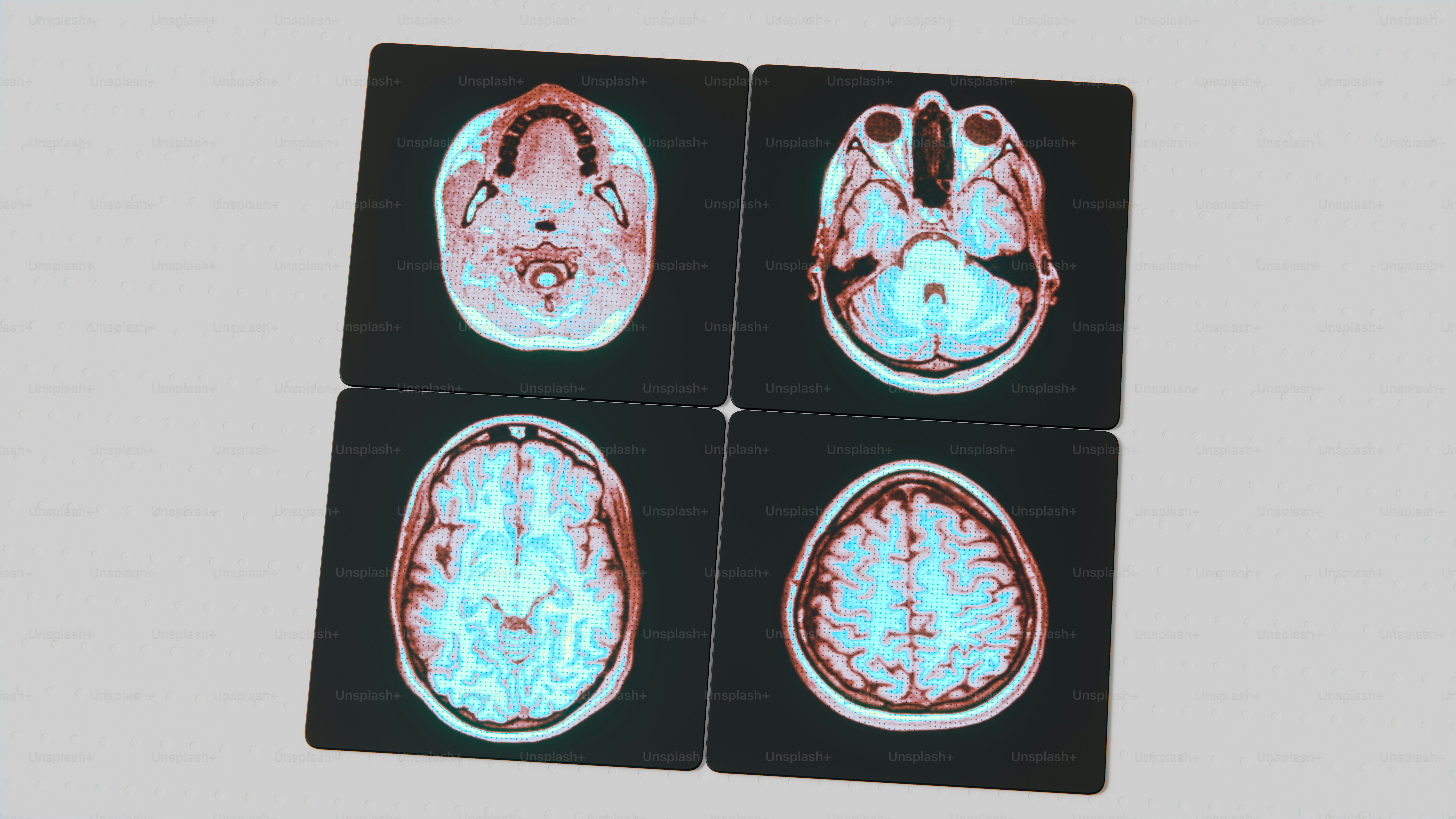 3D - MRI, PET and CT Scans | 100+ best free photos on Unsplash