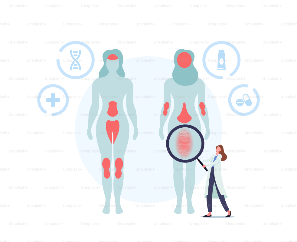 Psoriasis Concept. Doctor Character Show Affected Areas on Human Body ...