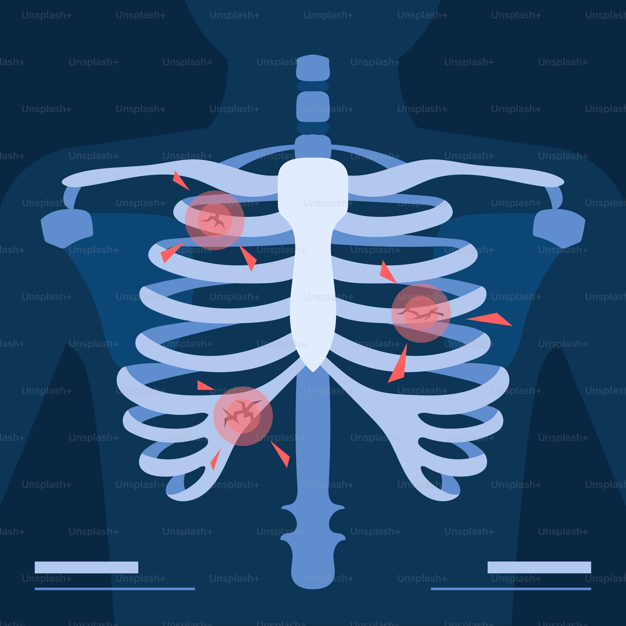 Un diagrama del tórax y el área del tórax vector – Imagen de Vector en ...