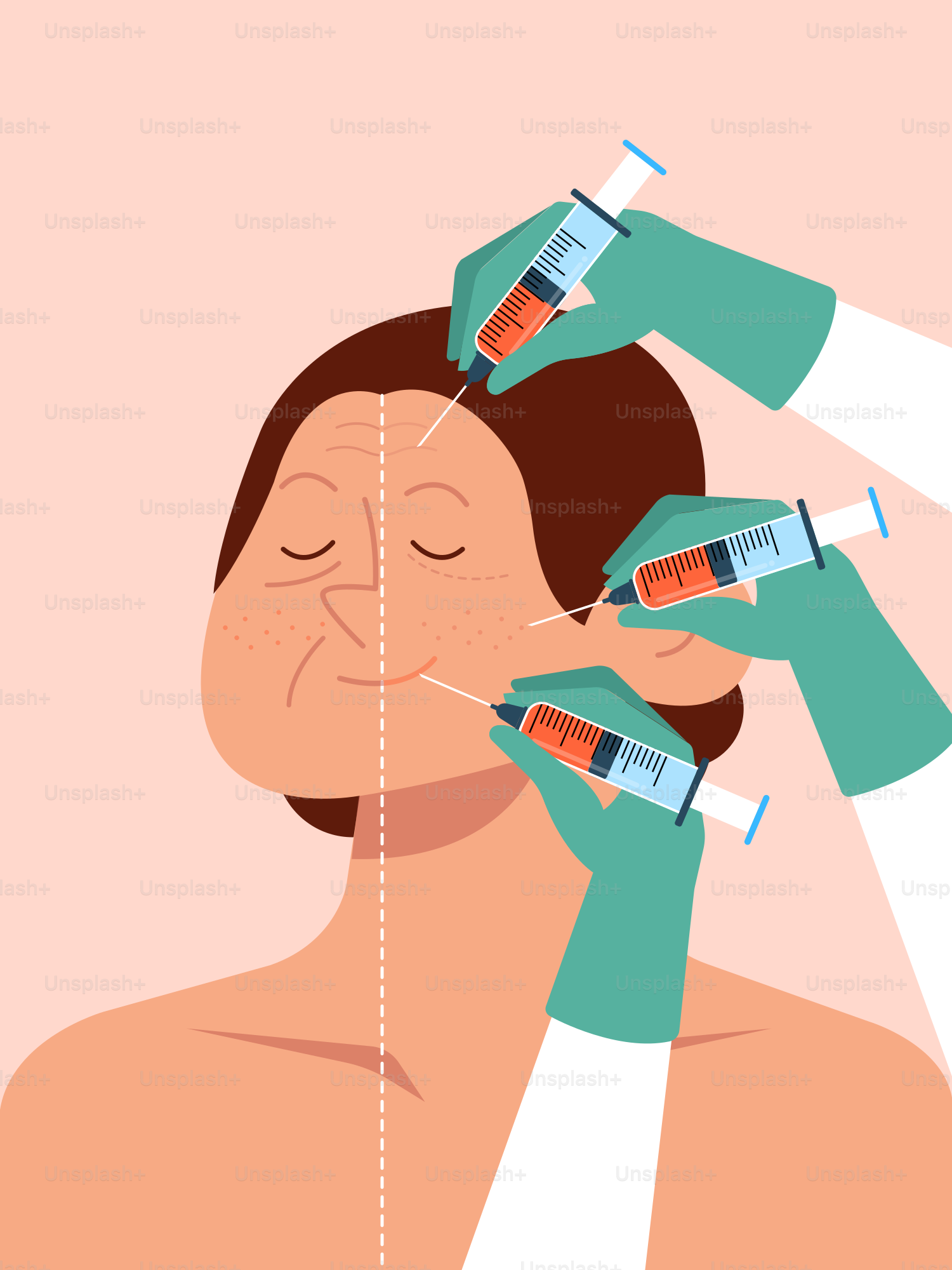 Uma mulher recebendo injeções de botula no rosto vetor – Imagem sobre ...